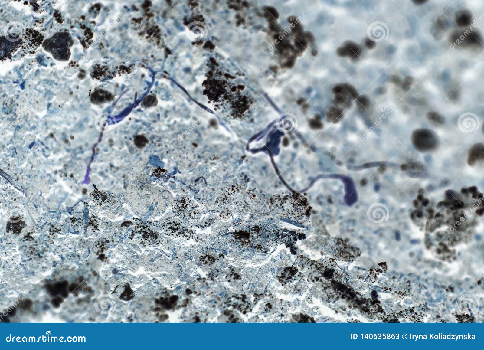 Bacteria or Cells Under a Microscope. Multiplication of Bacteria or ...