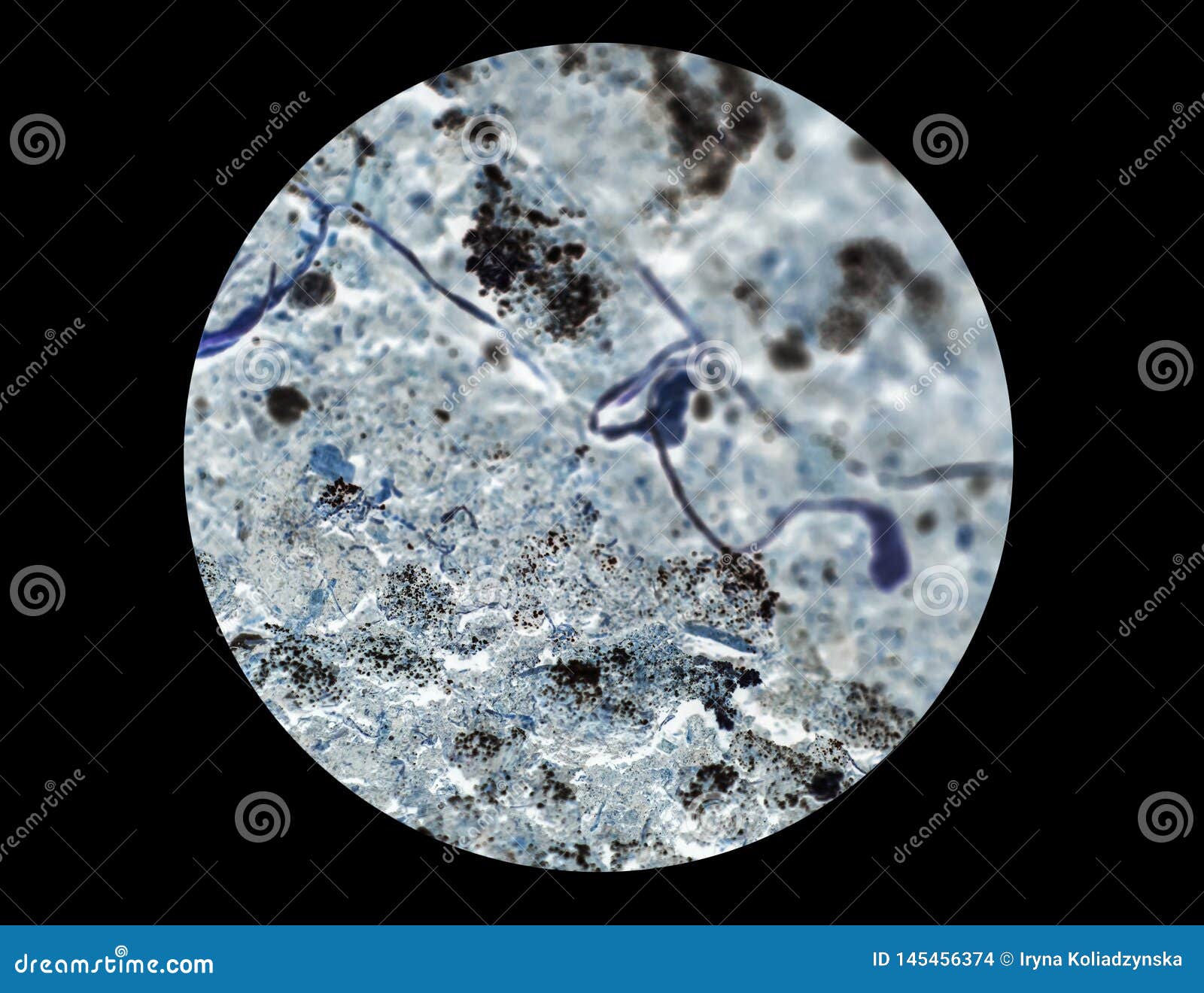 Bacteria or Cells Under a Microscope. Multiplication of Bacteria or ...