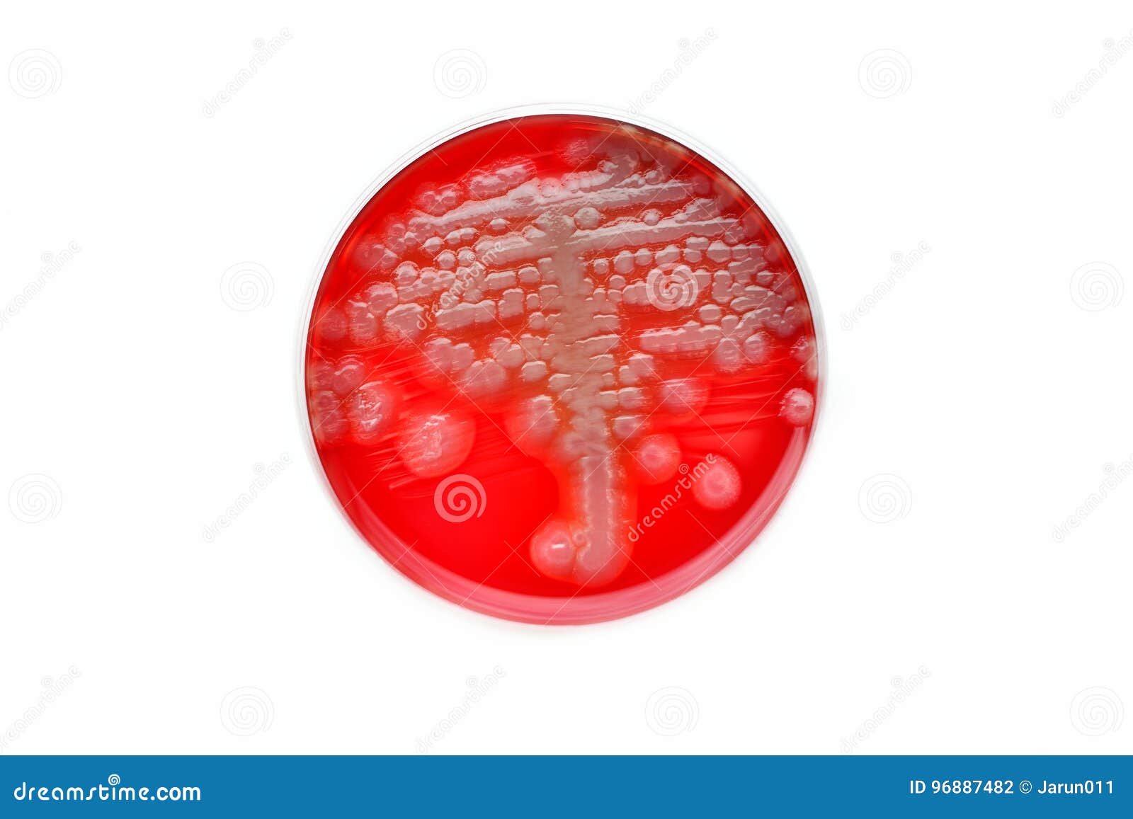 Colonies Of Bacteria Micrococcus Luteus On Tryptic Soy Agar Stock Photo ...
