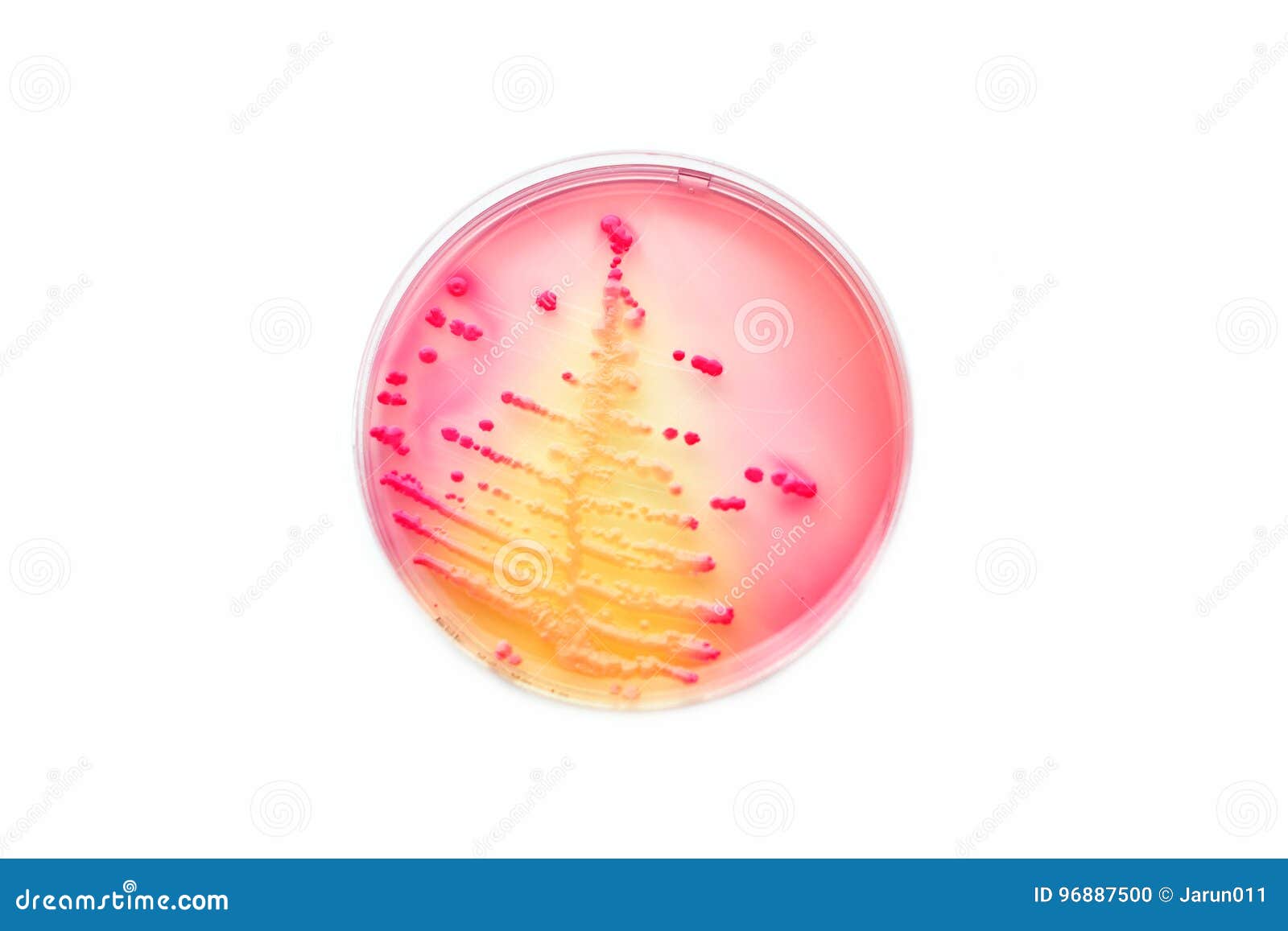 Colonies Of Bacteria Micrococcus Luteus On Tryptic Soy Agar Stock Photo ...