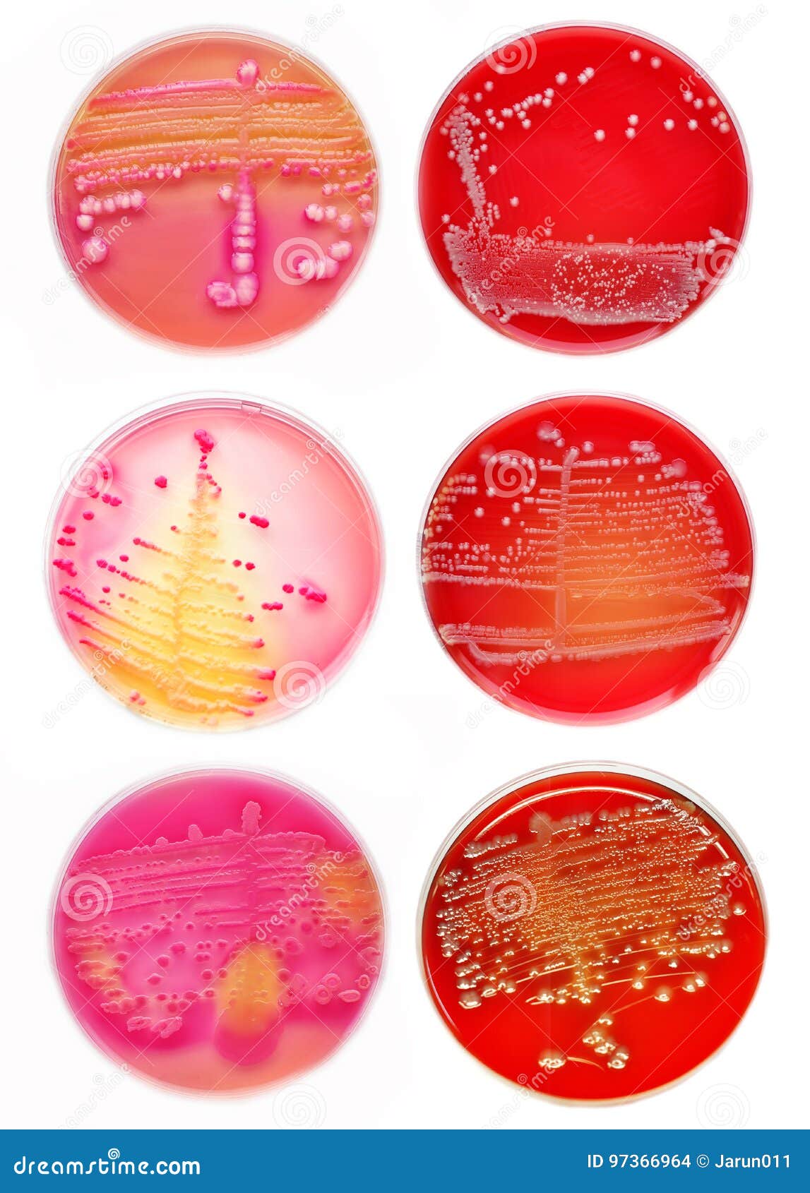 Klebsiella Pneumoniae. Urine Culture On Macconkey Agar Royalty-Free ...