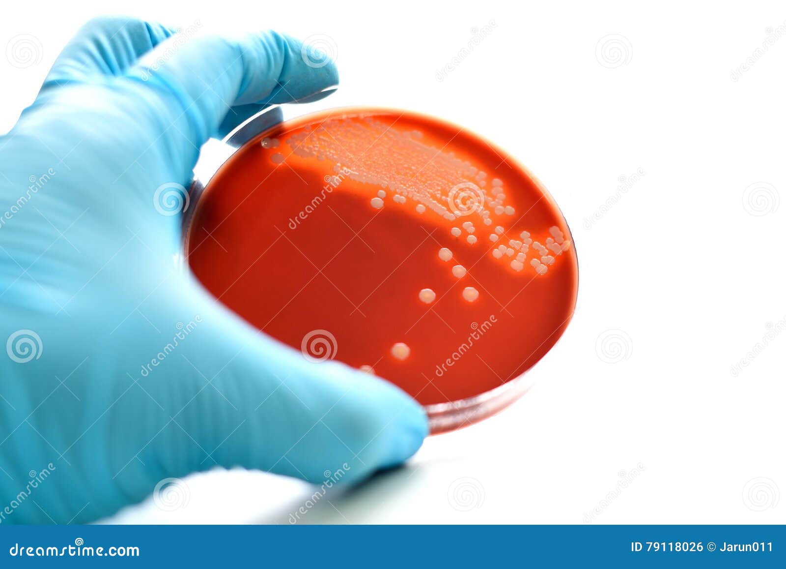 Bacterium Acinetobacter Baumannii Inside Biofilm Stock Illustration ... Bacterium Acinetobacter Baumannii Inside Biofilm Stock Illustration ...