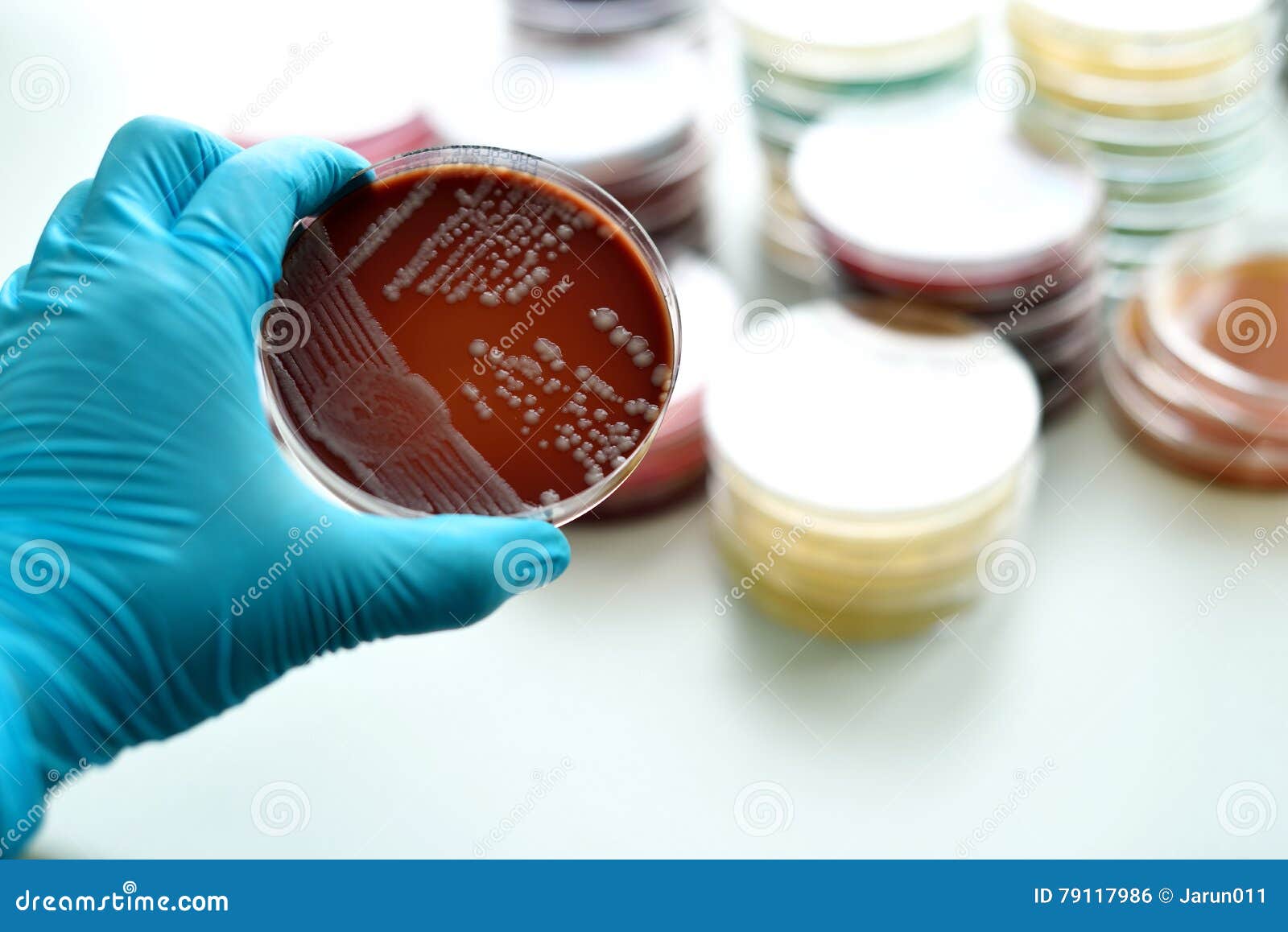 Chocolate Agar(CA) Are Selective Media For Bacteria Growth. Stock Image ...