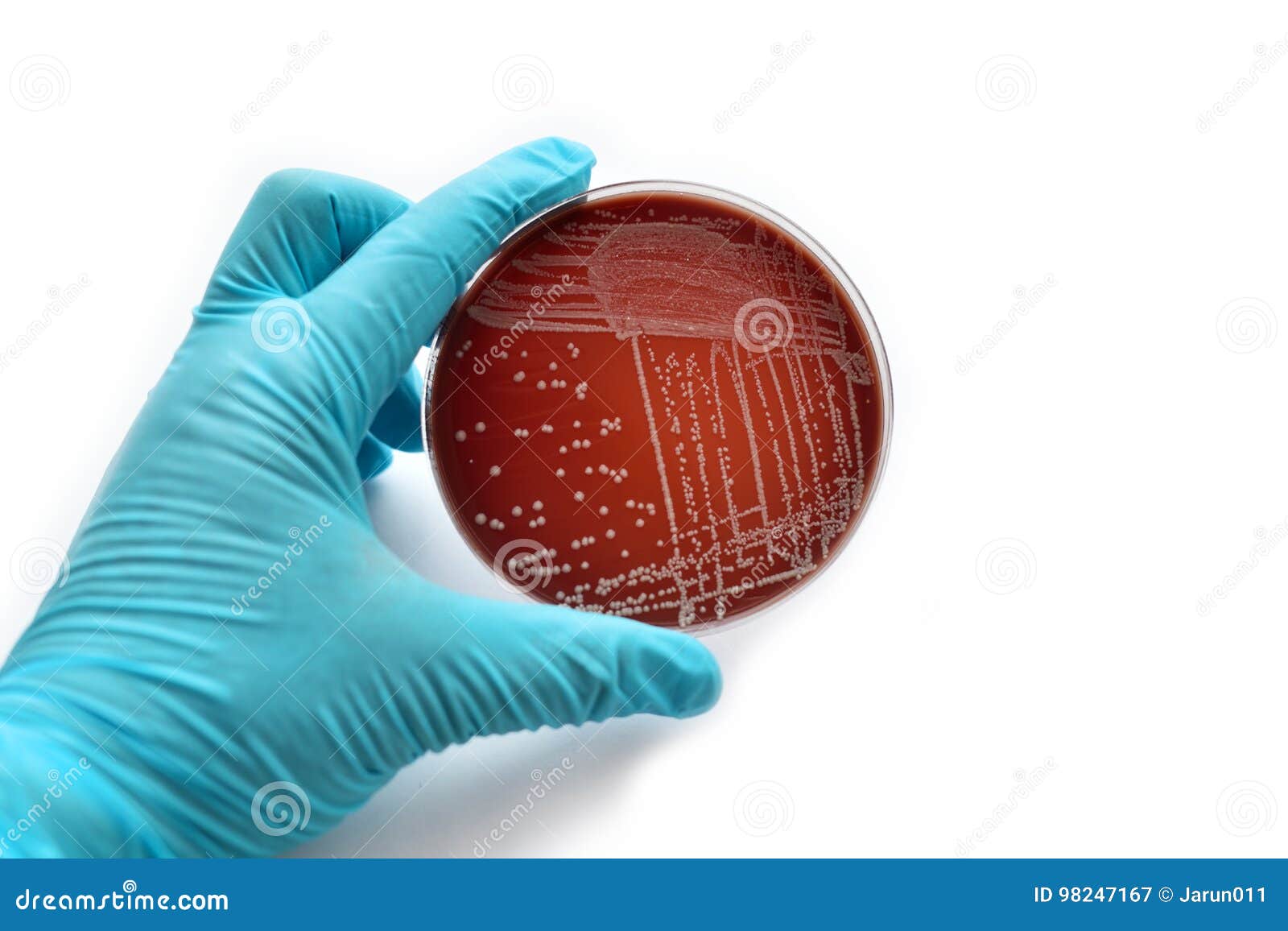 Chocolate Agar(CA) Are Selective Media For Bacteria Growth. Stock Image ...