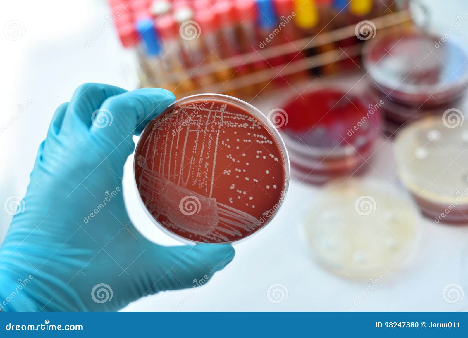 Chocolate Agar(CA) Are Selective Media For Bacteria Growth. Stock Image ...