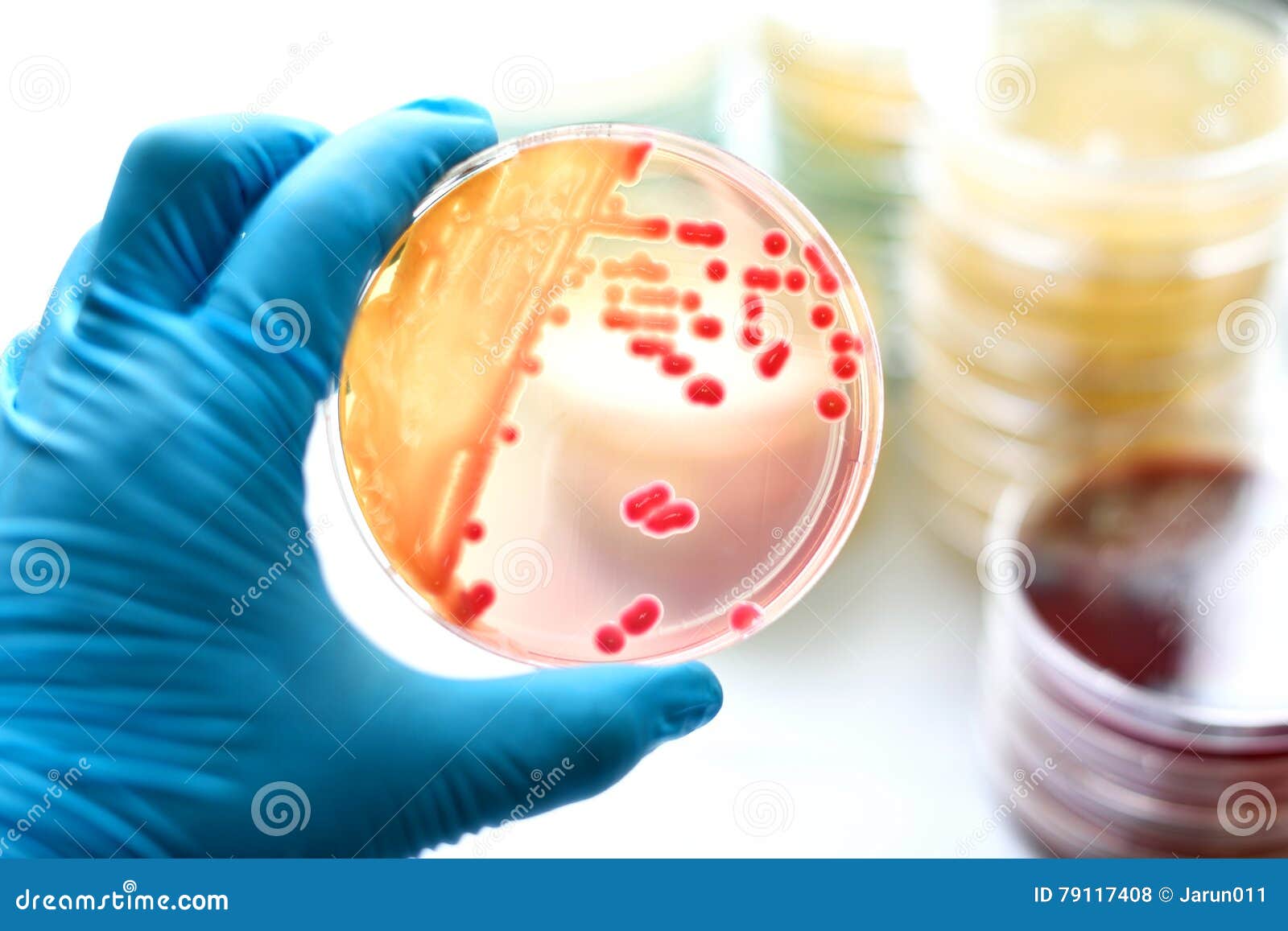 Bacteria culture stock photo. Image of blood, antibiotic - 79117408