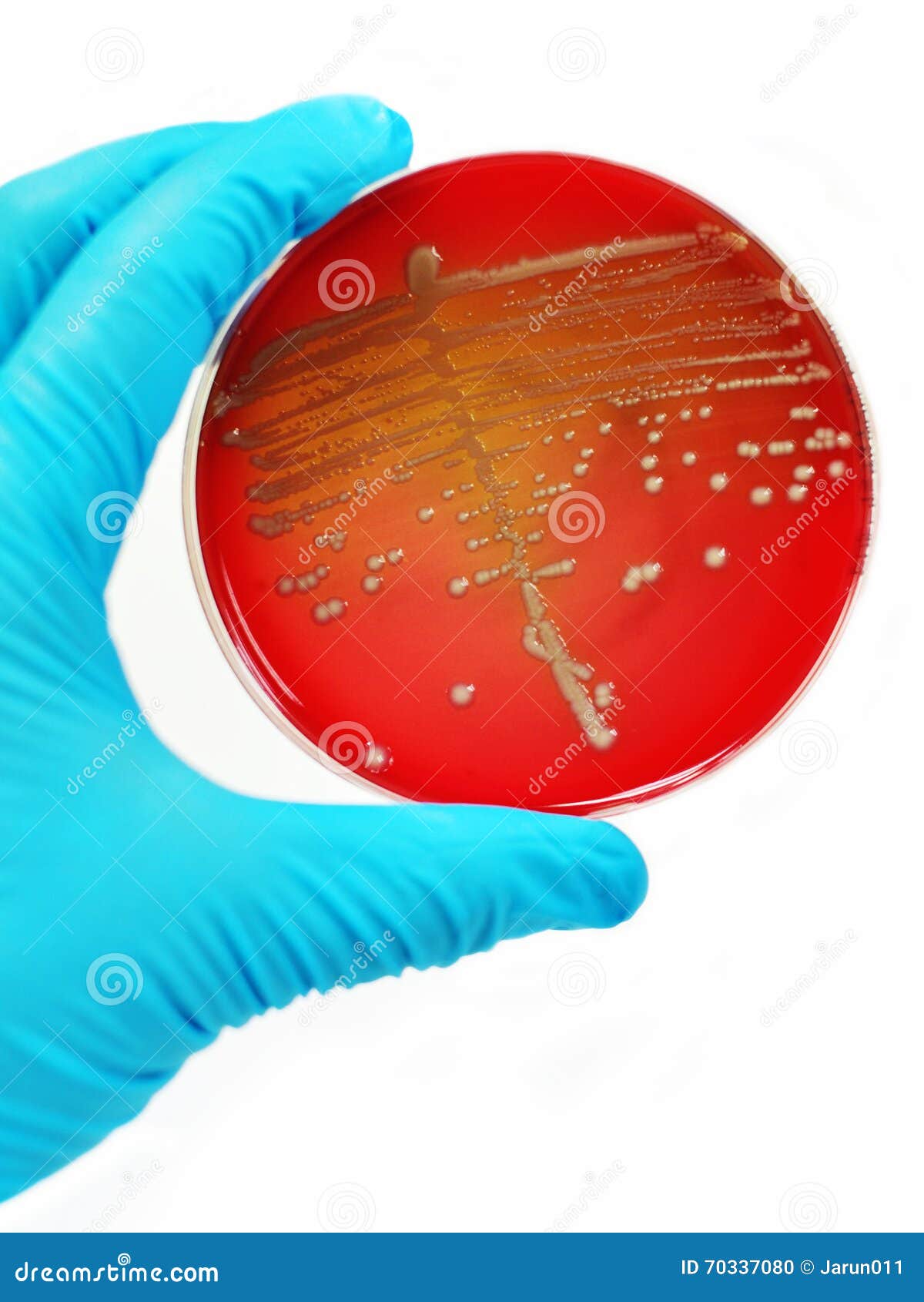 Bacteria culture stock photo. Image of klebisiella, identification ...