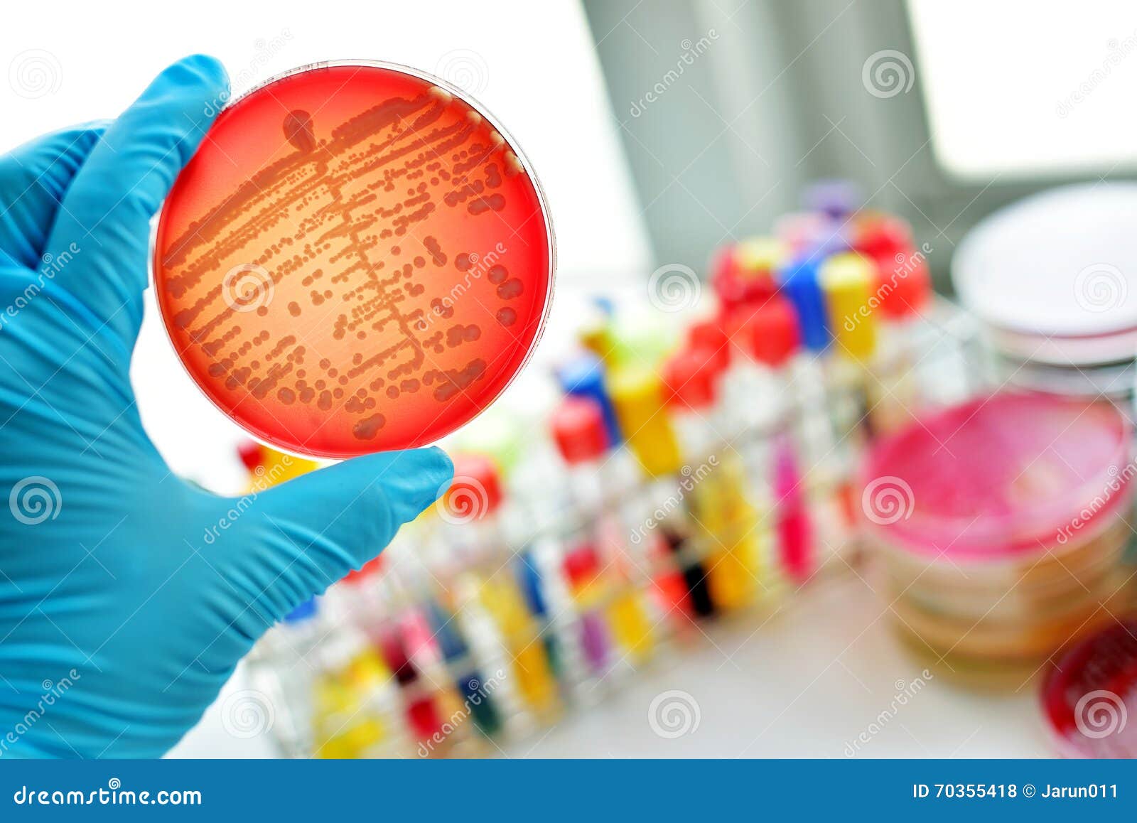 Bacteria culture stock photo. Image of diphtheria, colony - 70355418
