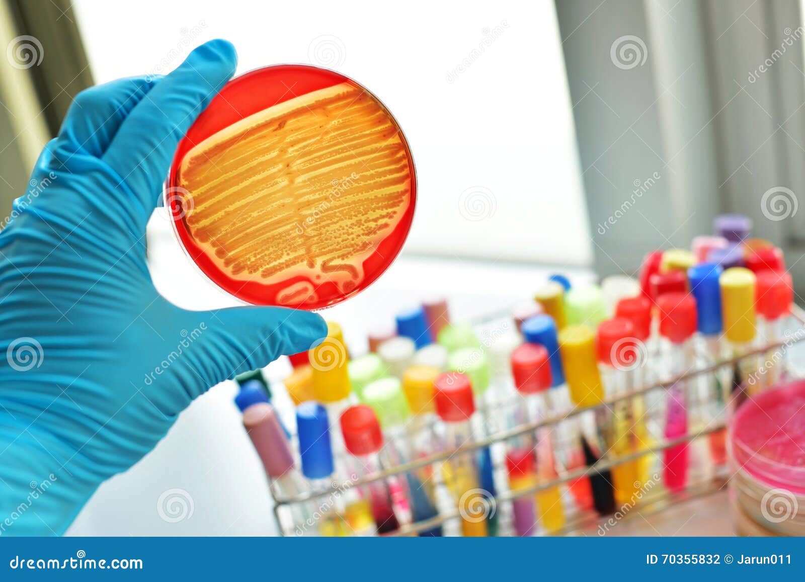 Bacteria culture stock photo. Image of blood, diphtheria - 70355832