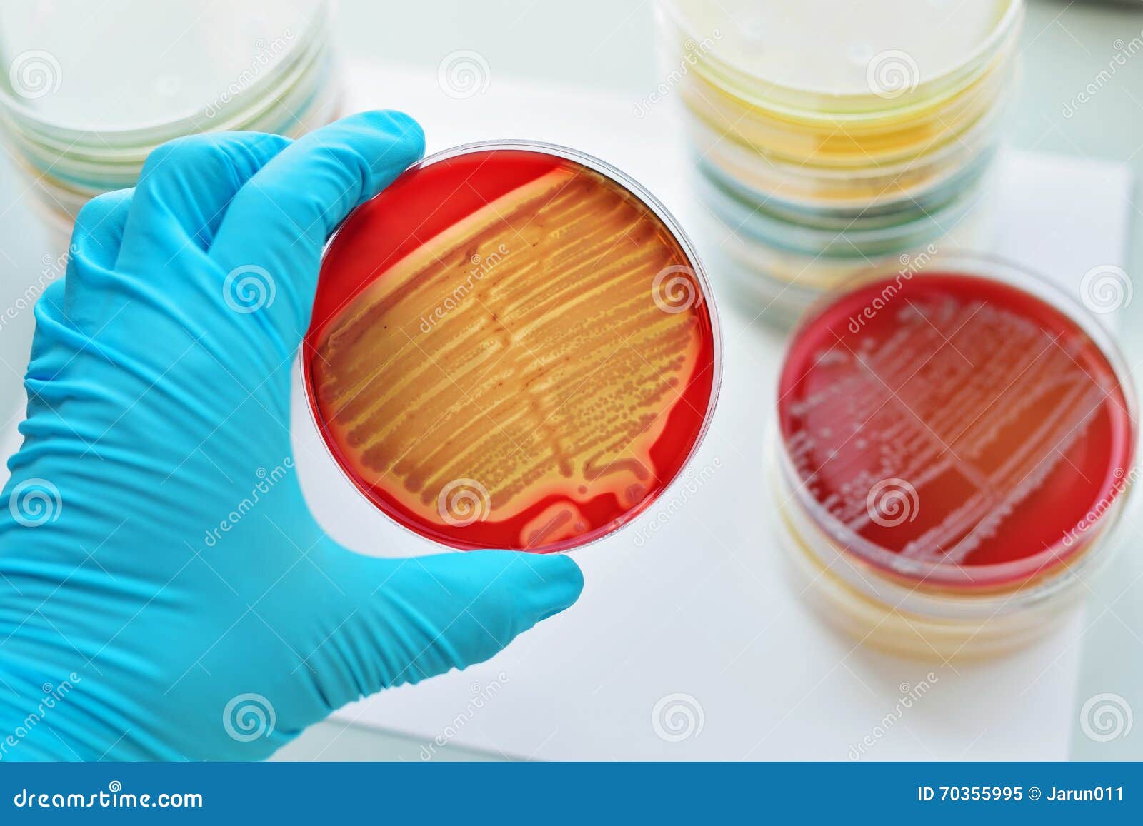 Bacteria culture stock image. Image of klebisiella, colonies - 70355995
