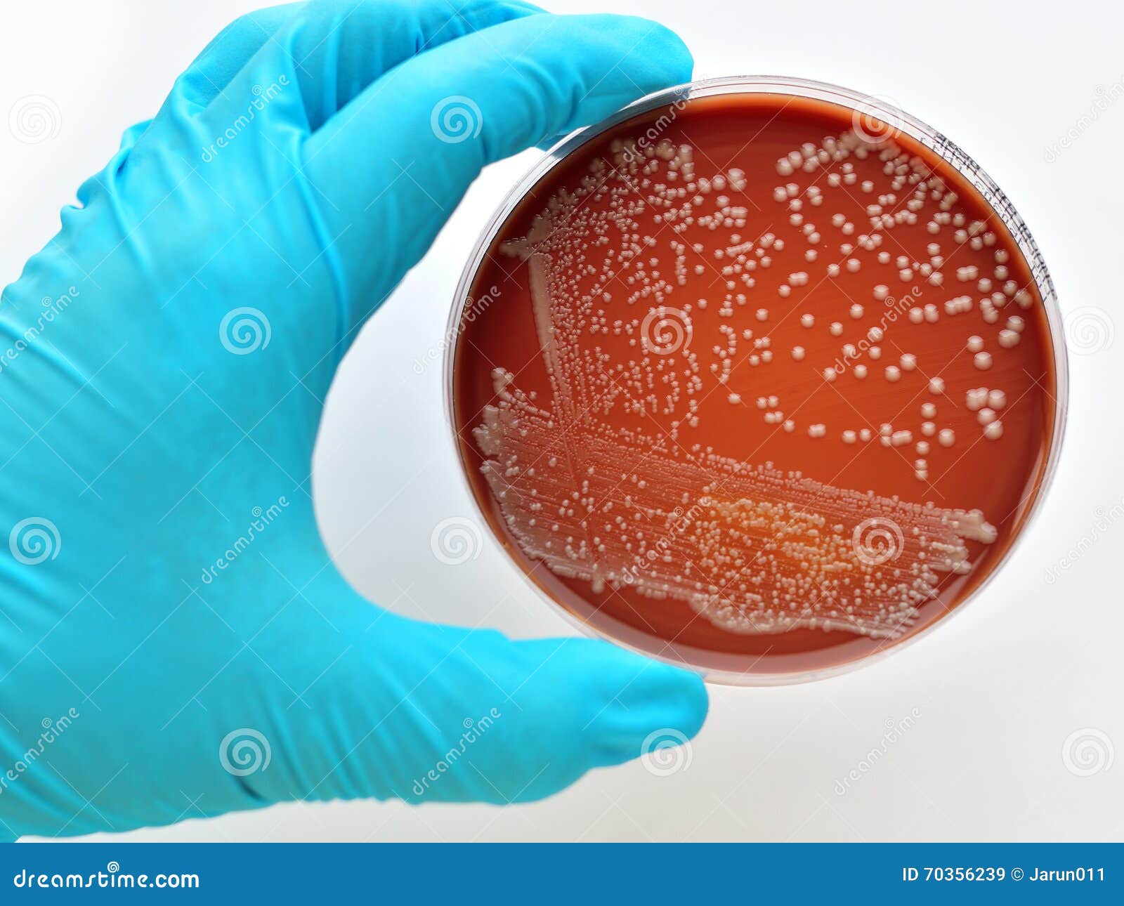 Bacteria culture stock image. Image of bacteria, chocolate - 70356239