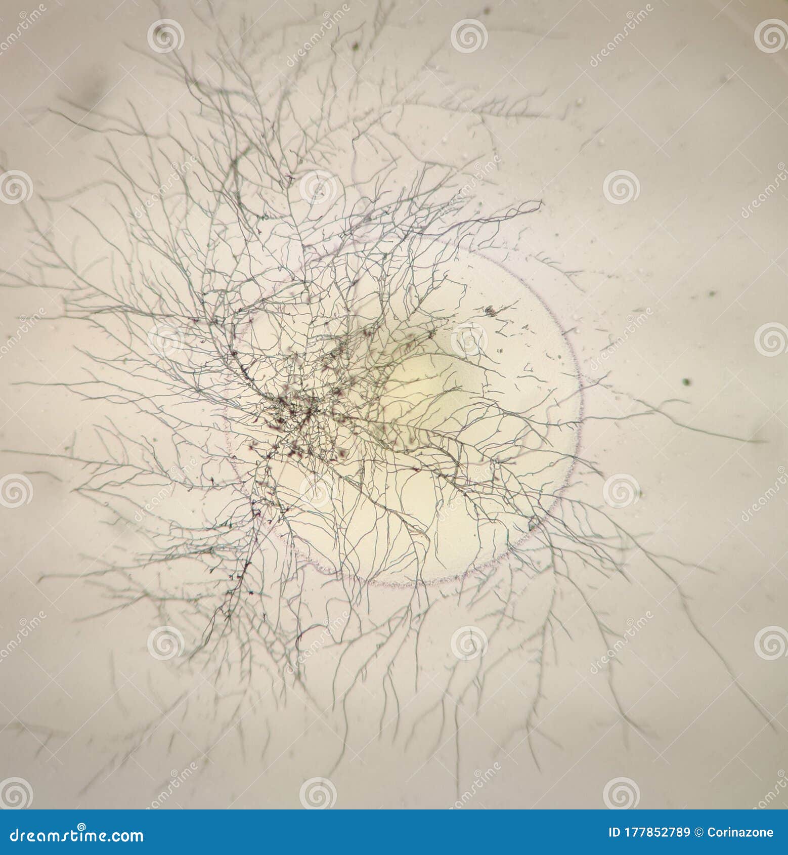 Fungi and Bacteria Under the Microscope Stock Image - Image of science ...