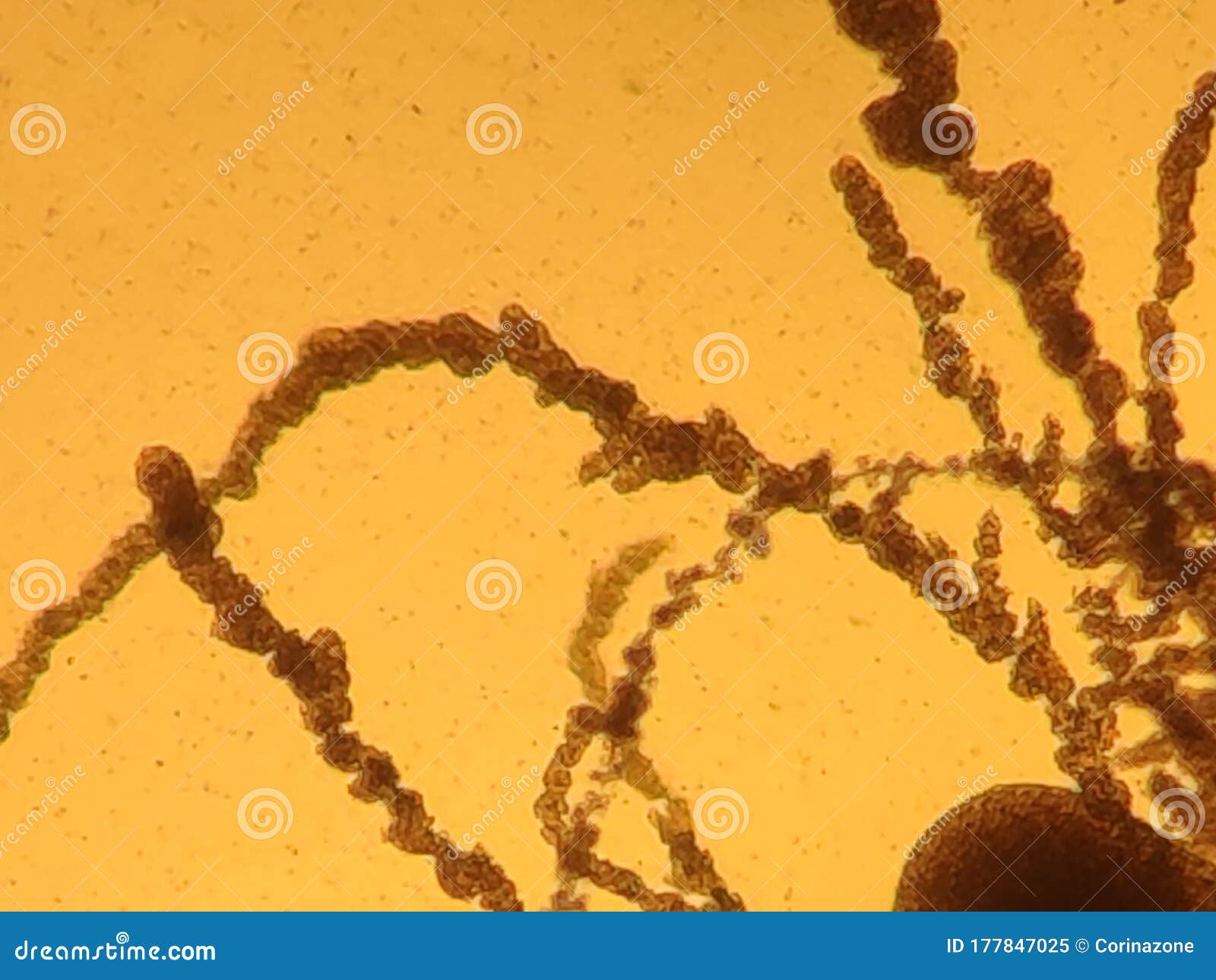 Bacteria and Fungi Under the Microscope Stock Image - Image of pattern ...