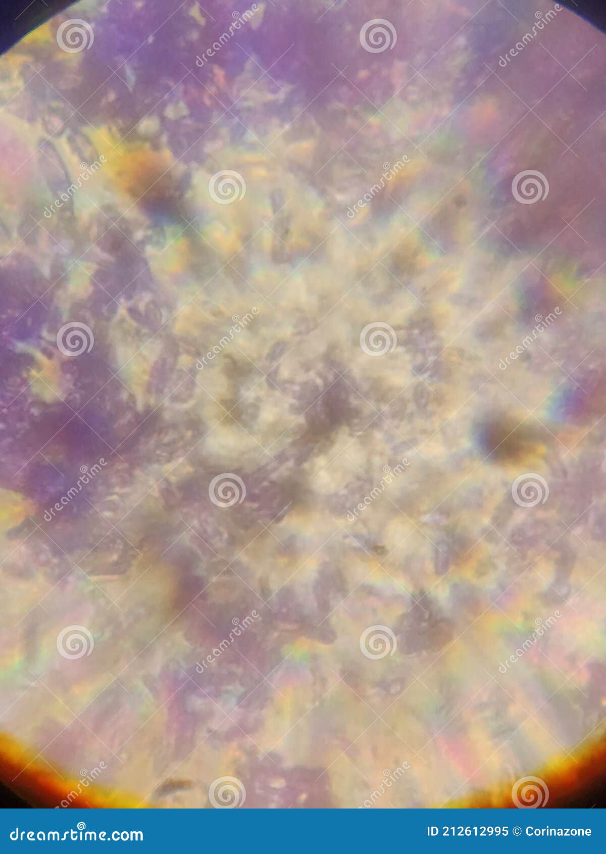 Bacteria Growing on Decaying Beet Stock Image - Image of microscope ...