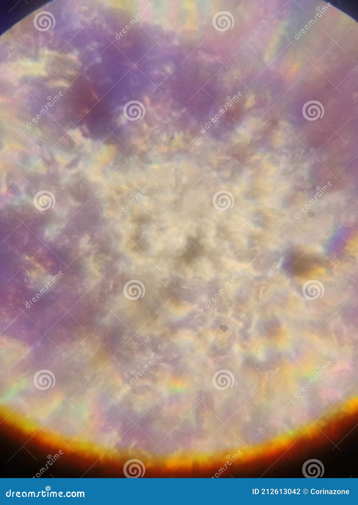 Bacteria Growing on Decaying Beet Stock Photo - Image of microscopy ...