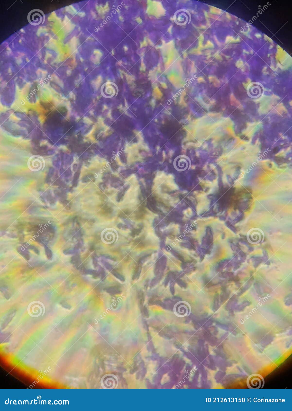 Bacteria Growing on Decaying Beet Stock Photo - Image of bacteria ...