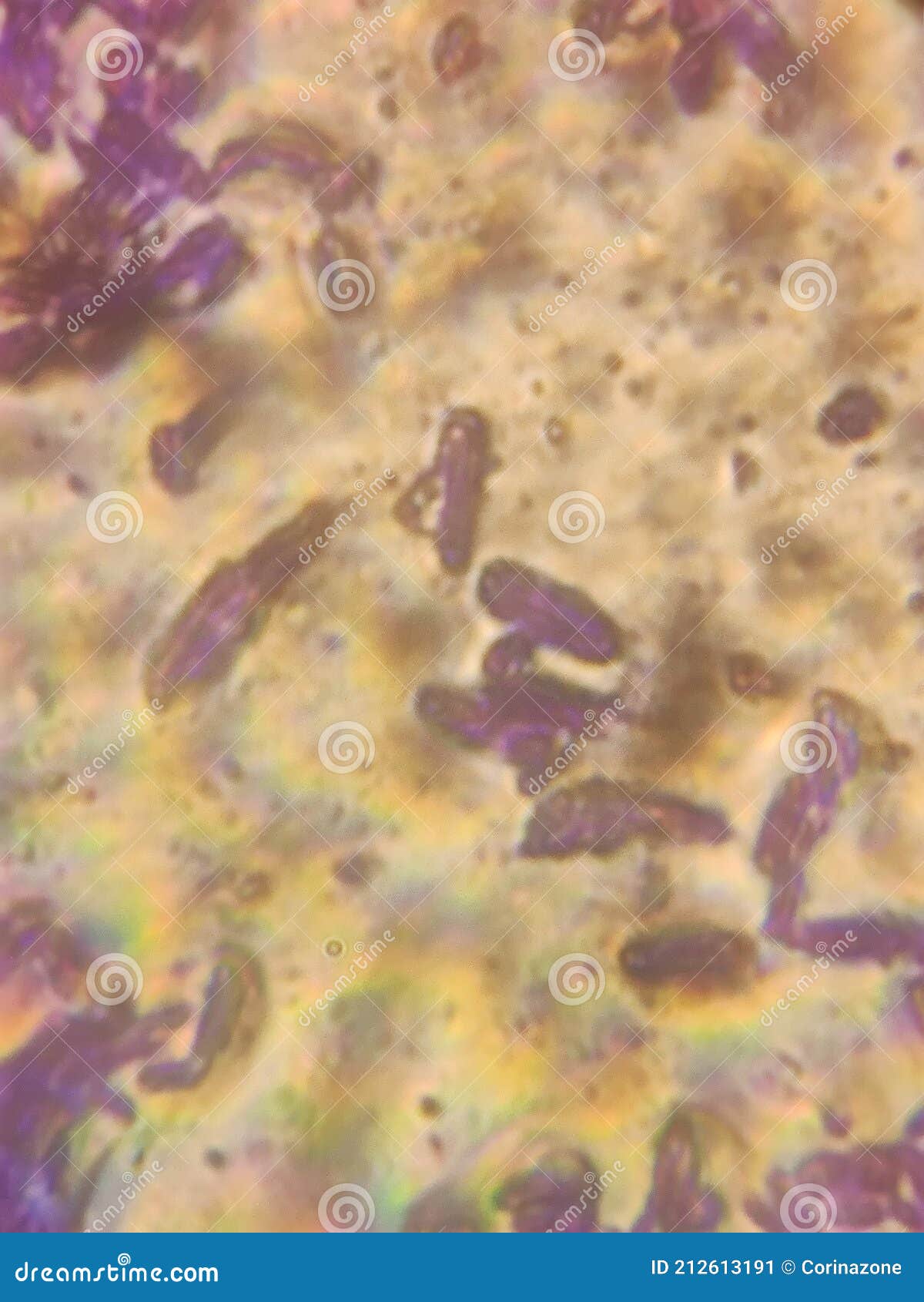 Bacteria Growing on Decaying Beet Stock Image - Image of vulgaris ...