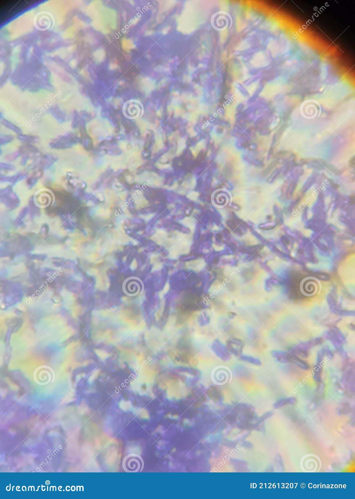 Bacteria Growing on Decaying Beet Stock Image - Image of biology, beet ...