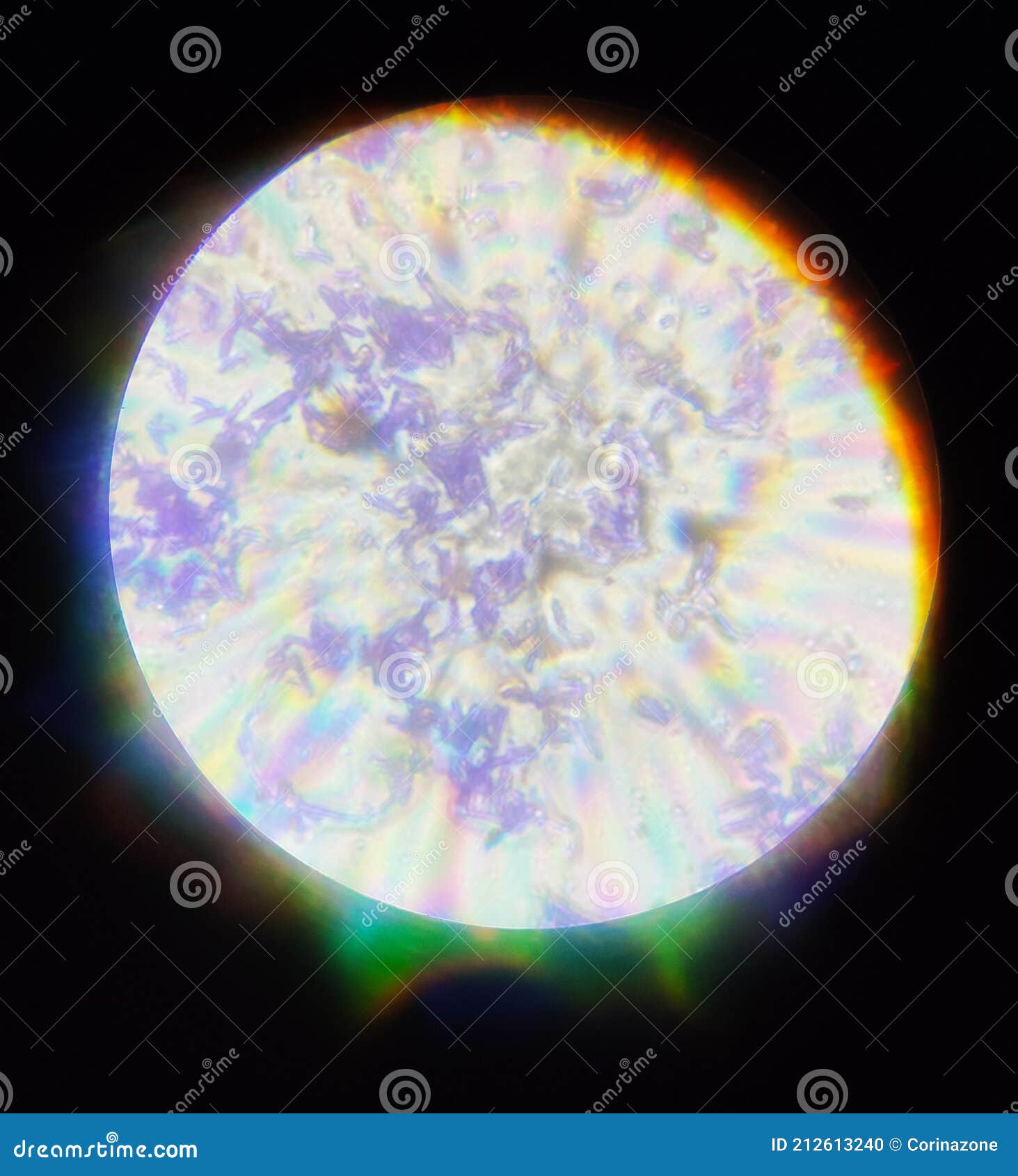 Bacteria Growing on Decaying Beet Stock Photo - Image of growing ...