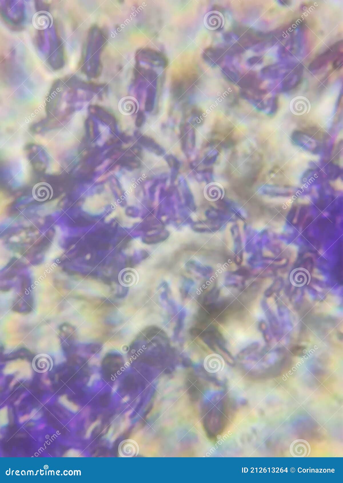 Bacteria Growing on Decaying Beet Stock Photo - Image of vulgaris ...