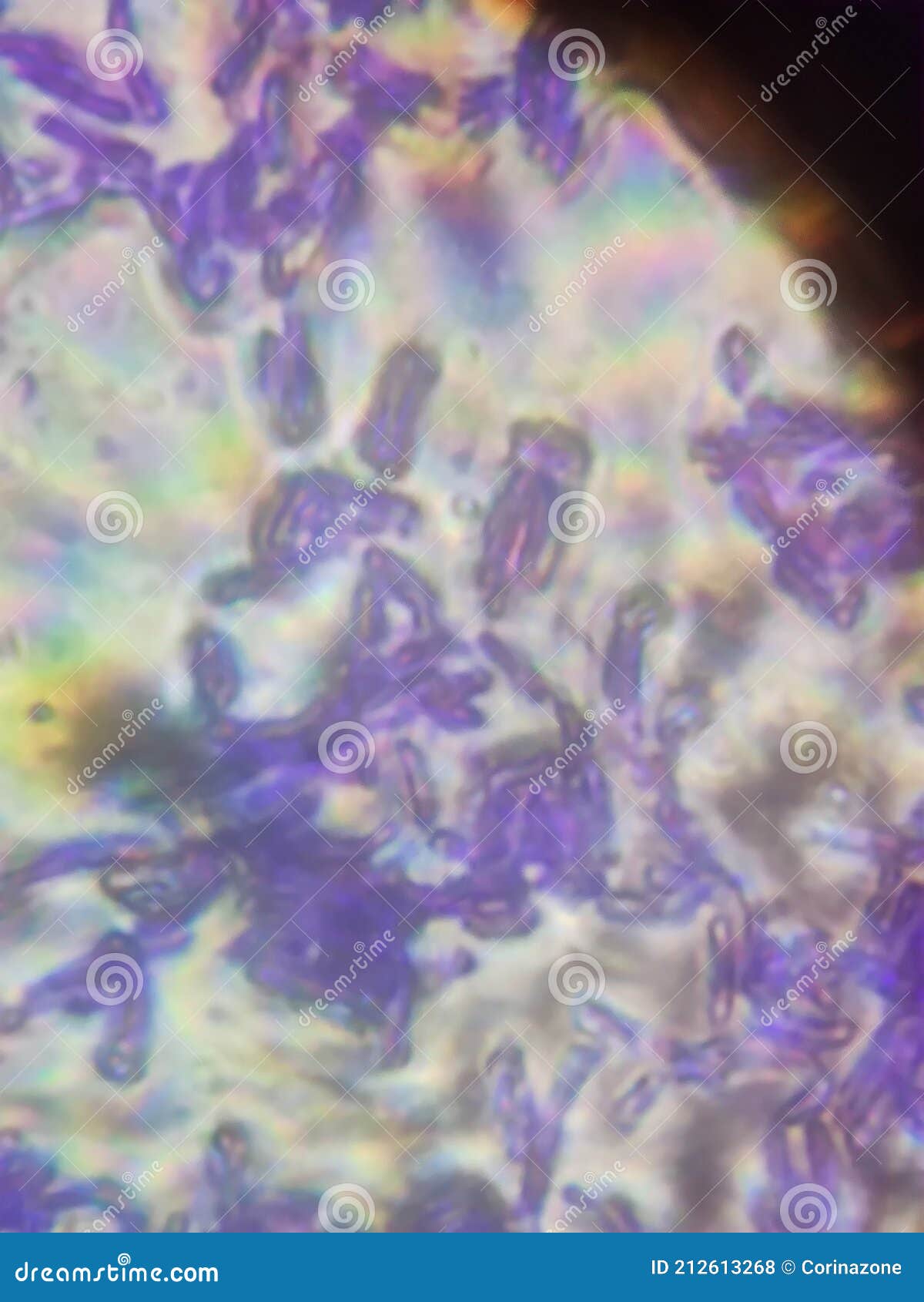 Bacteria Growing on Decaying Beet Stock Photo - Image of microbiology ...