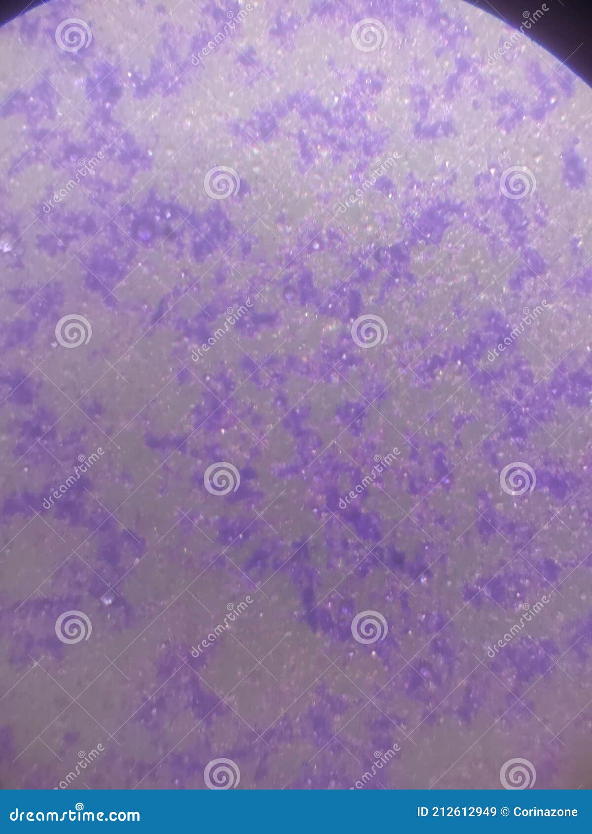 Bacteria Growing on Decaying Beet Stock Image - Image of microbiology ...