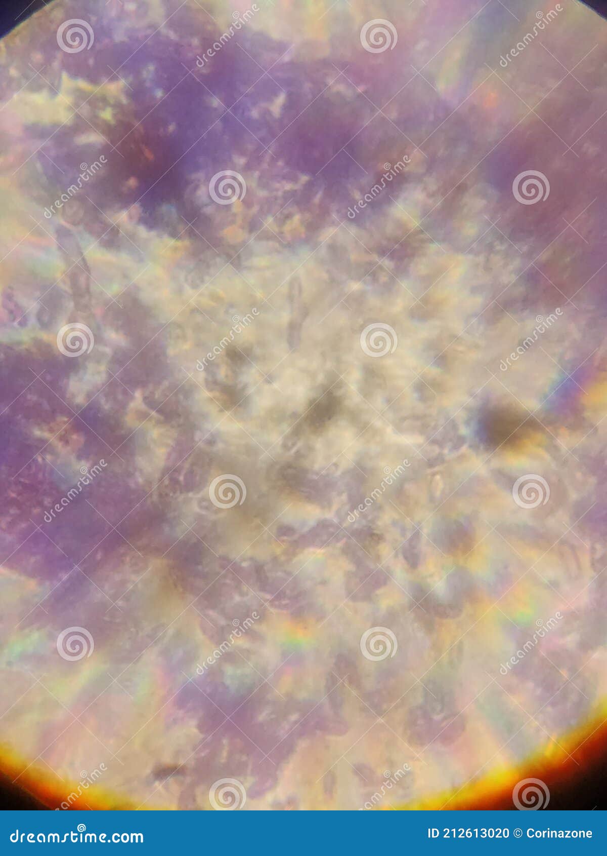 Bacteria Growing on Decaying Beet Stock Photo - Image of science ...