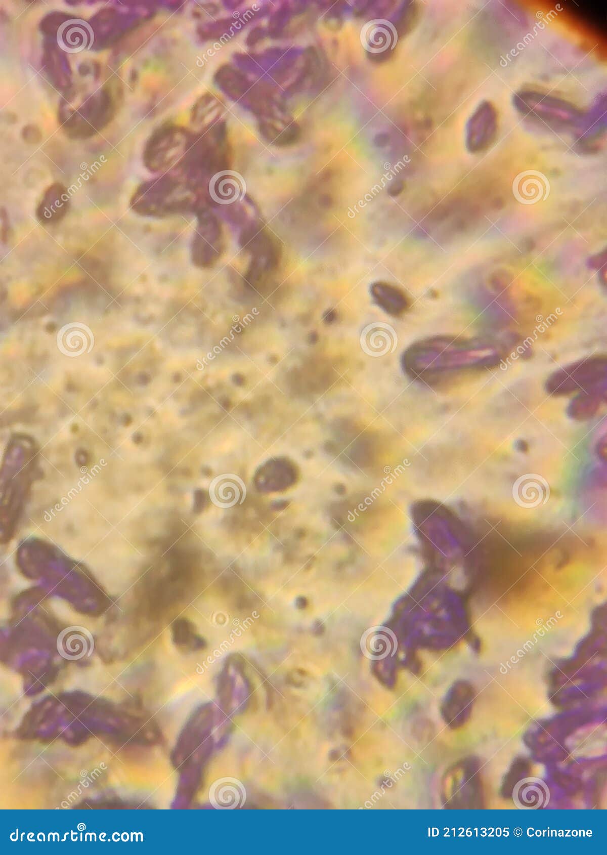 Bacteria Growing on Decaying Beet Stock Image - Image of microbiology ...