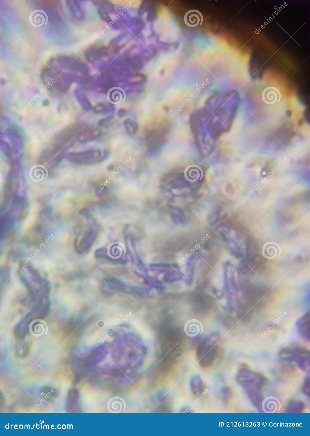 Bacteria Growing on Decaying Beet Stock Image - Image of bacteria ...