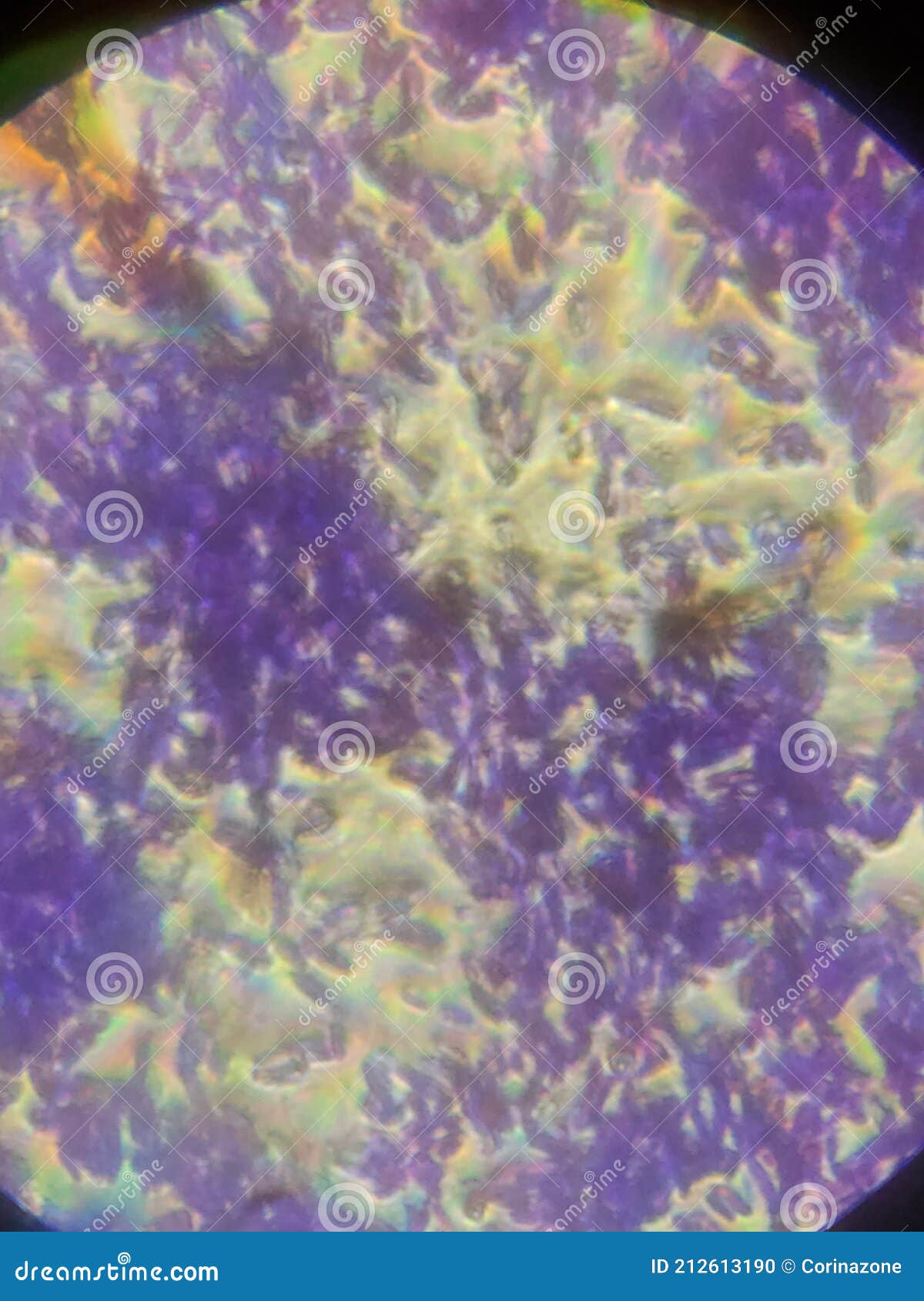 Bacteria Growing on Decaying Beet Stock Photo - Image of bacteria ...