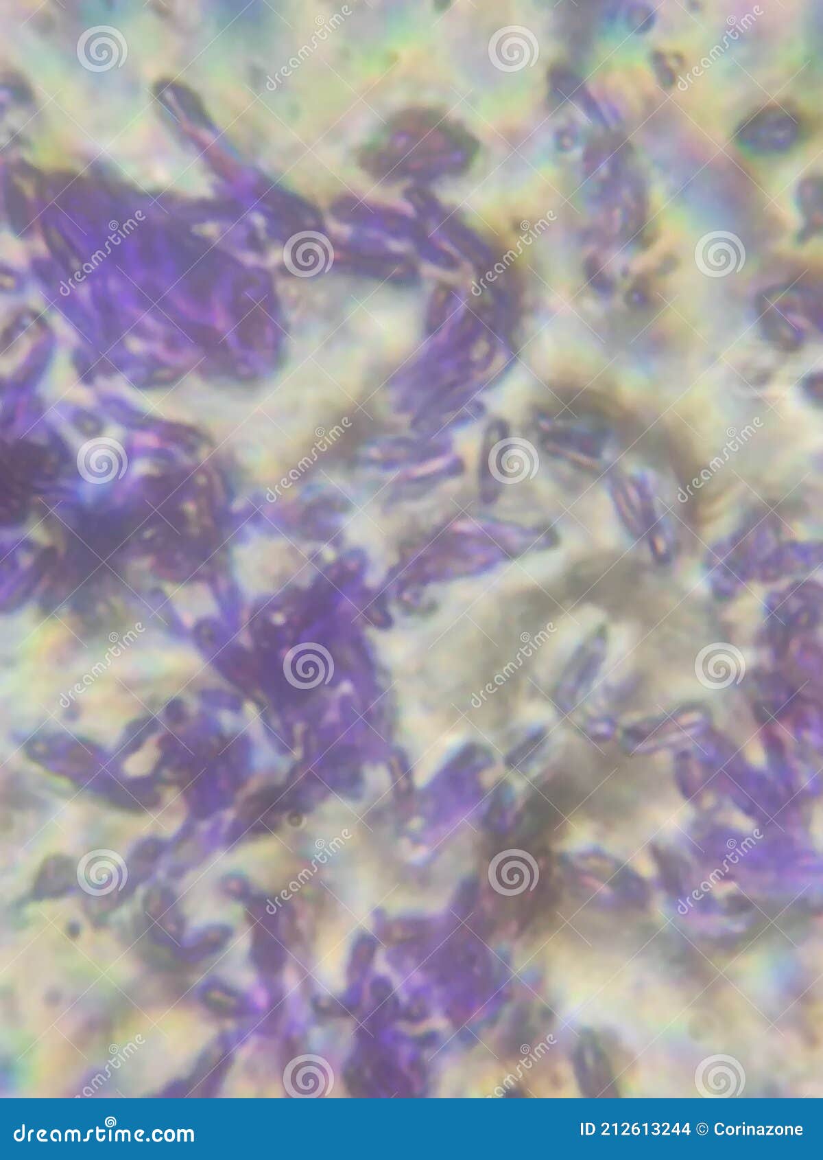 Bacteria Growing on Decaying Beet Stock Photo - Image of biology ...