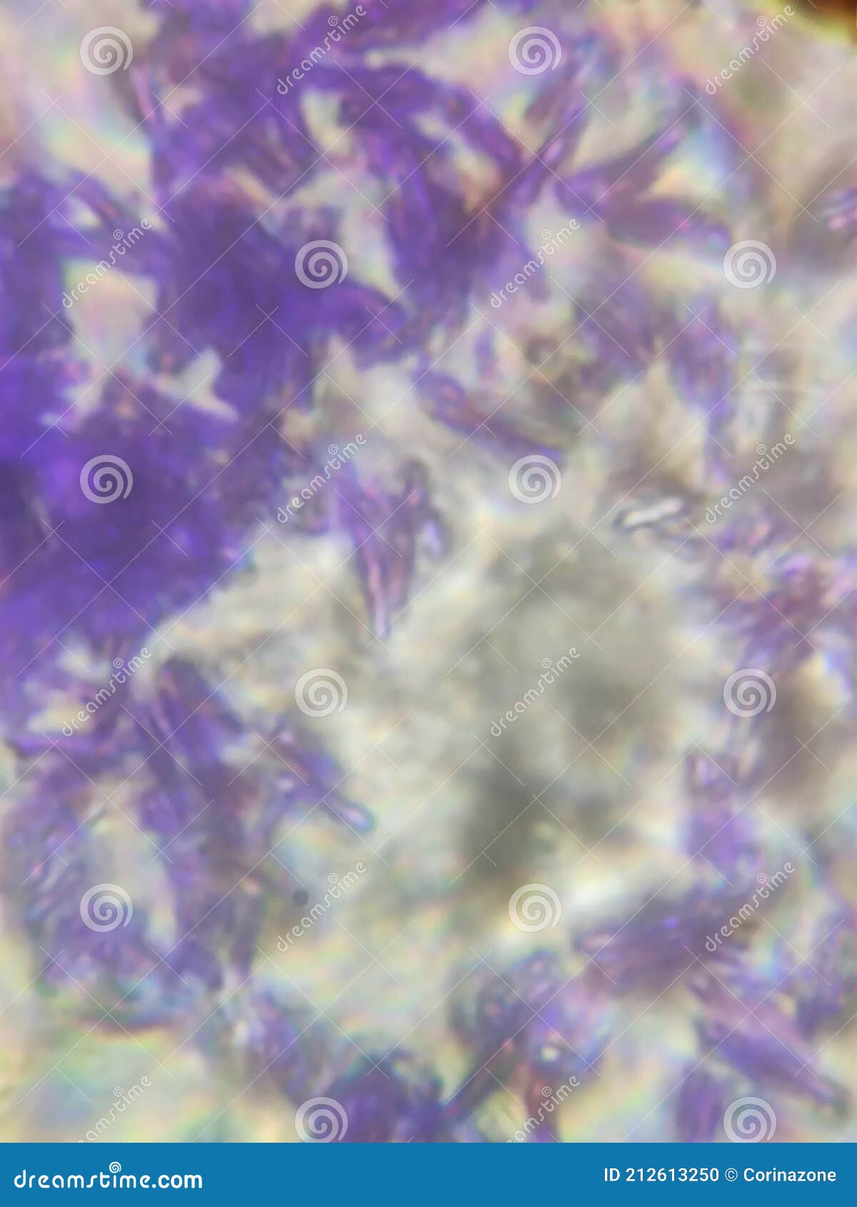 Bacteria Growing on Decaying Beet Stock Photo - Image of science ...
