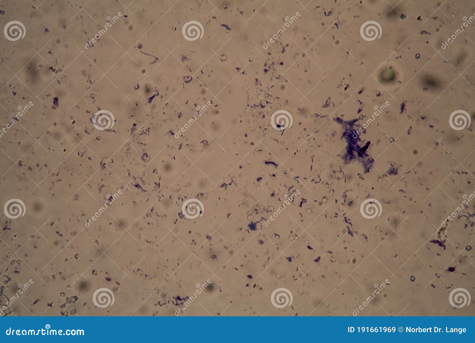 Bacteria from the Leaven 400x Stock Illustration - Illustration of ...