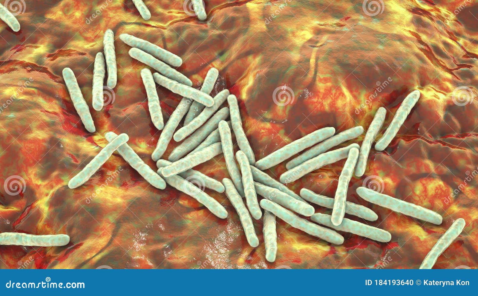 Mycobacterium Avium-intracellulare, Non-tuberculous Mycrobacteria Stock ...