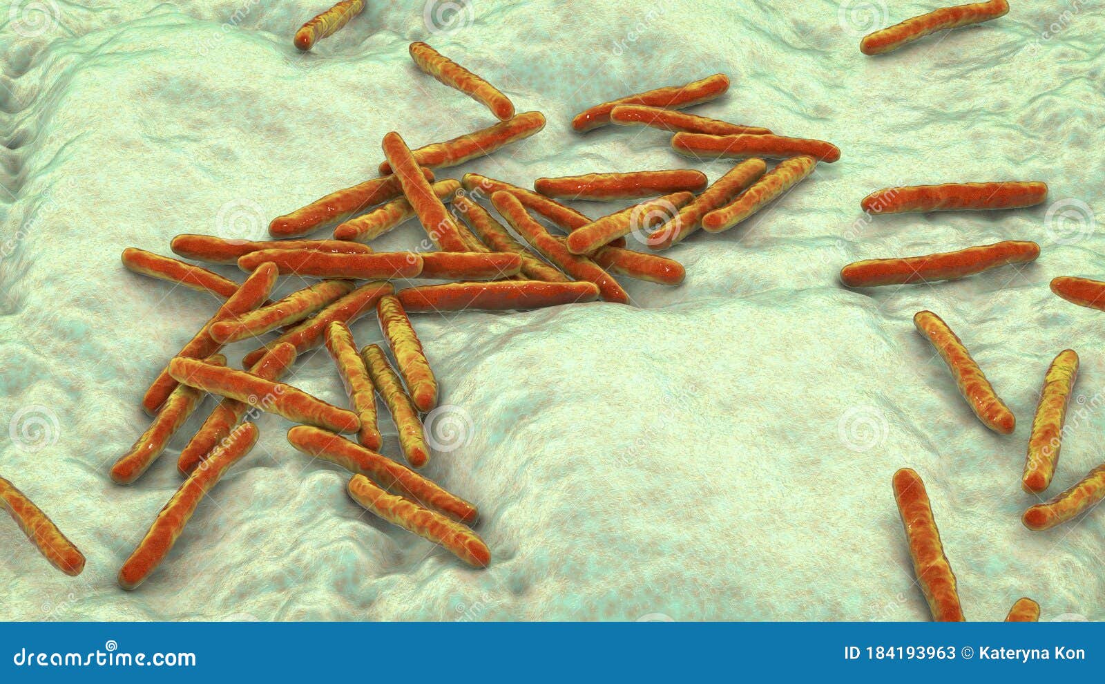 Mycobacterium Avium-intracellulare, Non-tuberculous Mycrobacteria Stock ...