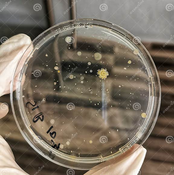 Bacteria on Plate Count Agar Stock Photo - Image of laboratory, testing ...