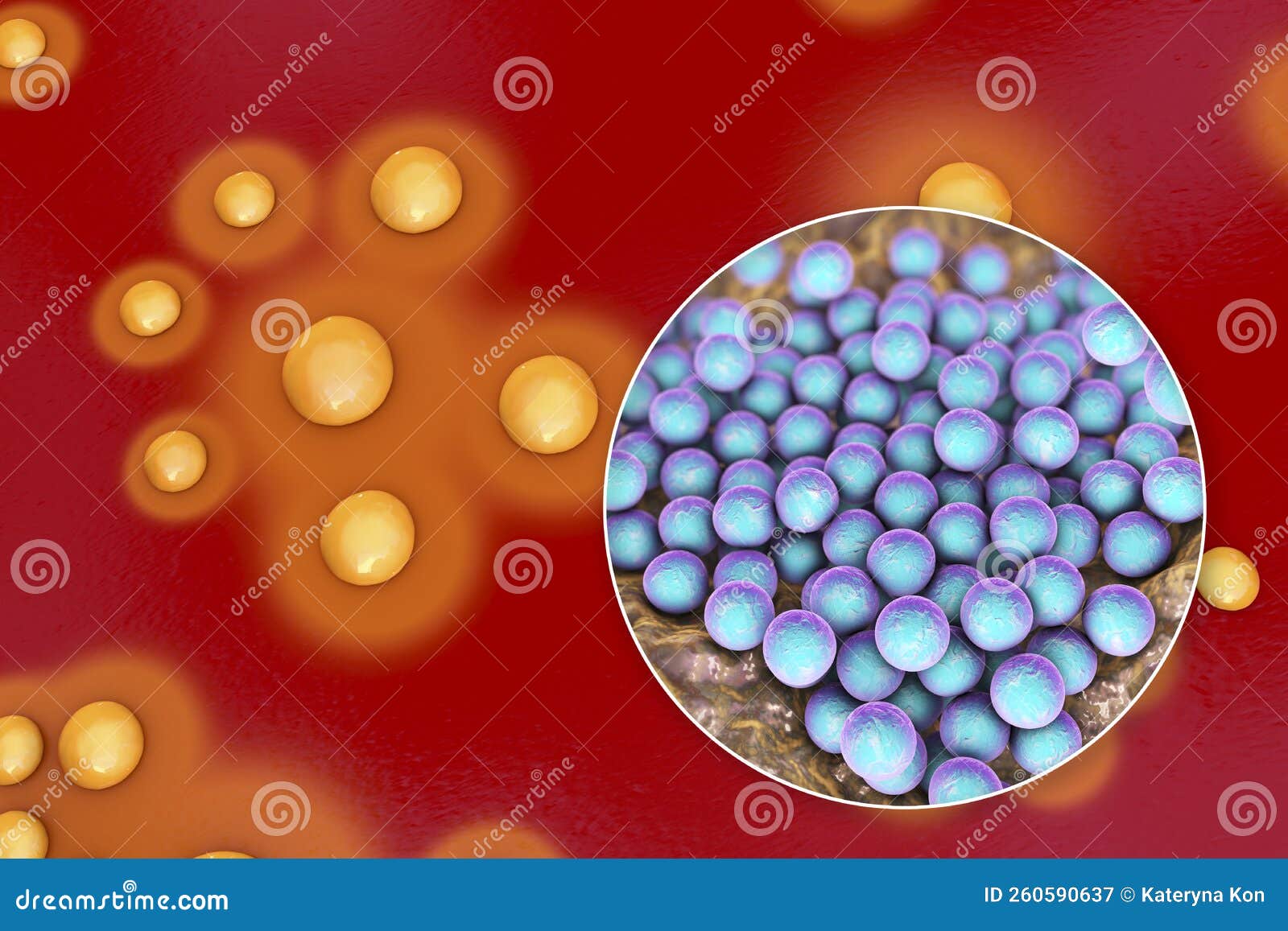 Bacteria Staphylococcus Aureus Stock Illustration | CartoonDealer.com ...