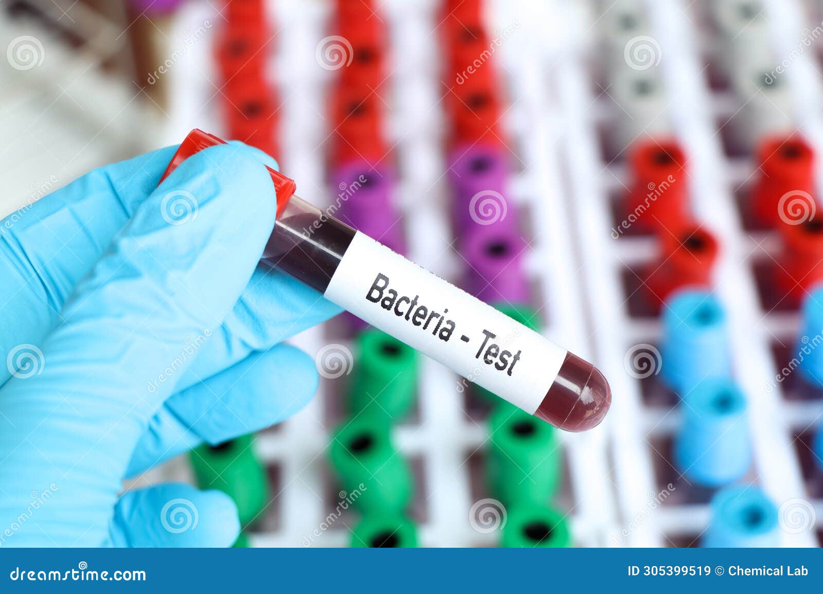 Bacteria Test, Blood Sample To Analyze in the Laboratory Stock Image ...