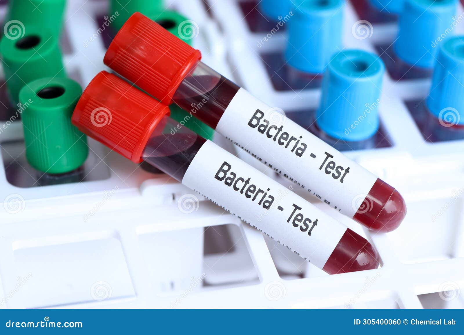 Bacteria Test, Blood Sample To Analyze in the Laboratory Stock Photo ...