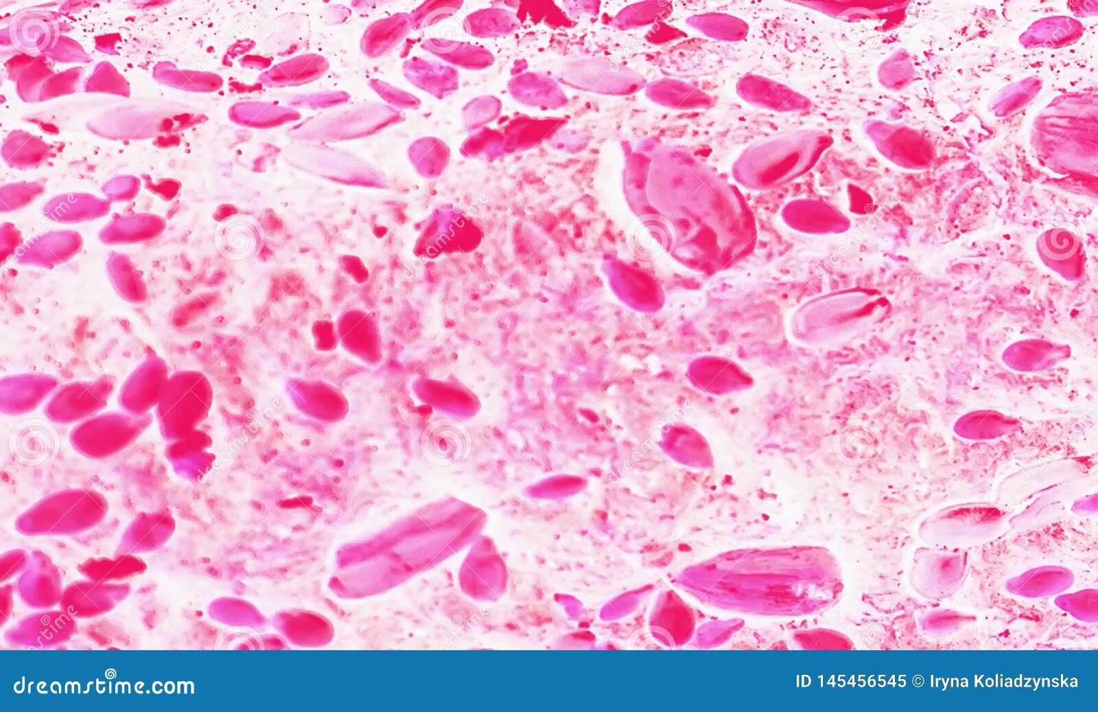 Bacteria Under The Microscope Background. Background Bacteria Stock ...