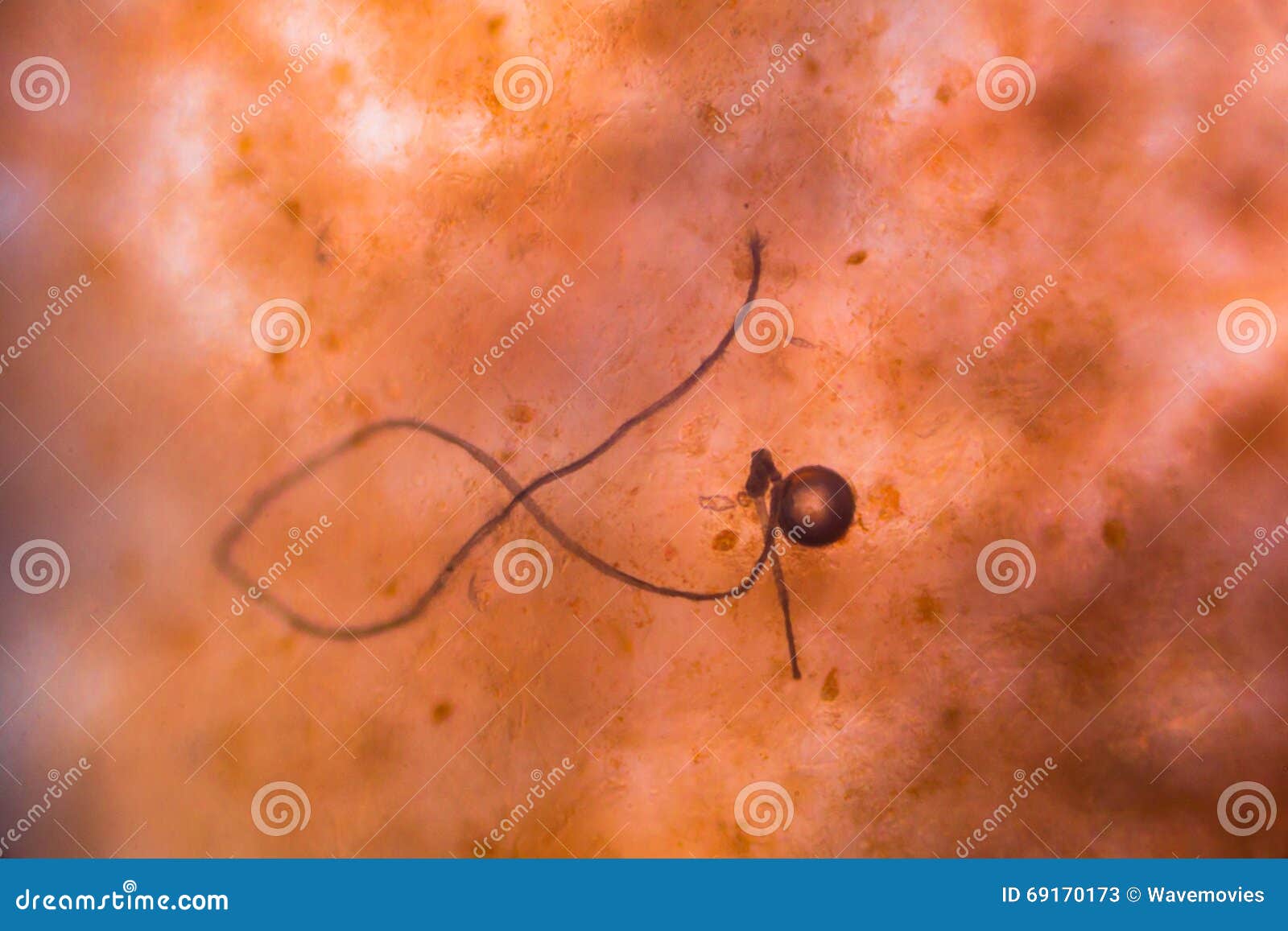 Bacteria Under the Microscope Stock Image - Image of cell, germs: 69170173