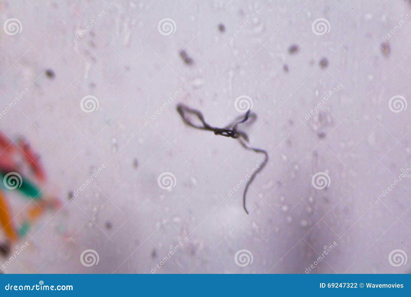 Bacteria Under the Microscope Stock Photo - Image of flagella ...