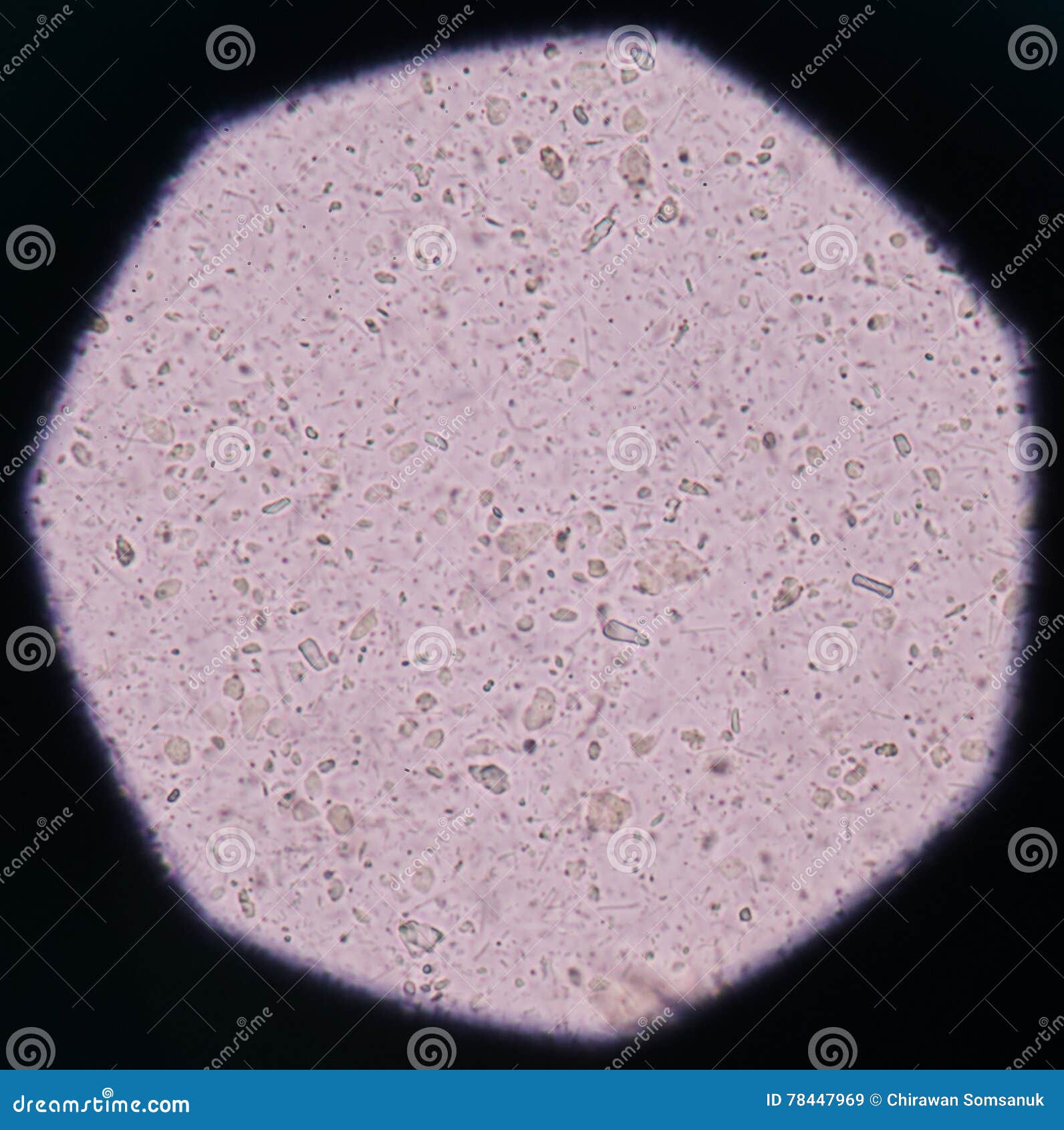 Bacteria in Urinary Tract Infections. Stock Image - Image of fever ...