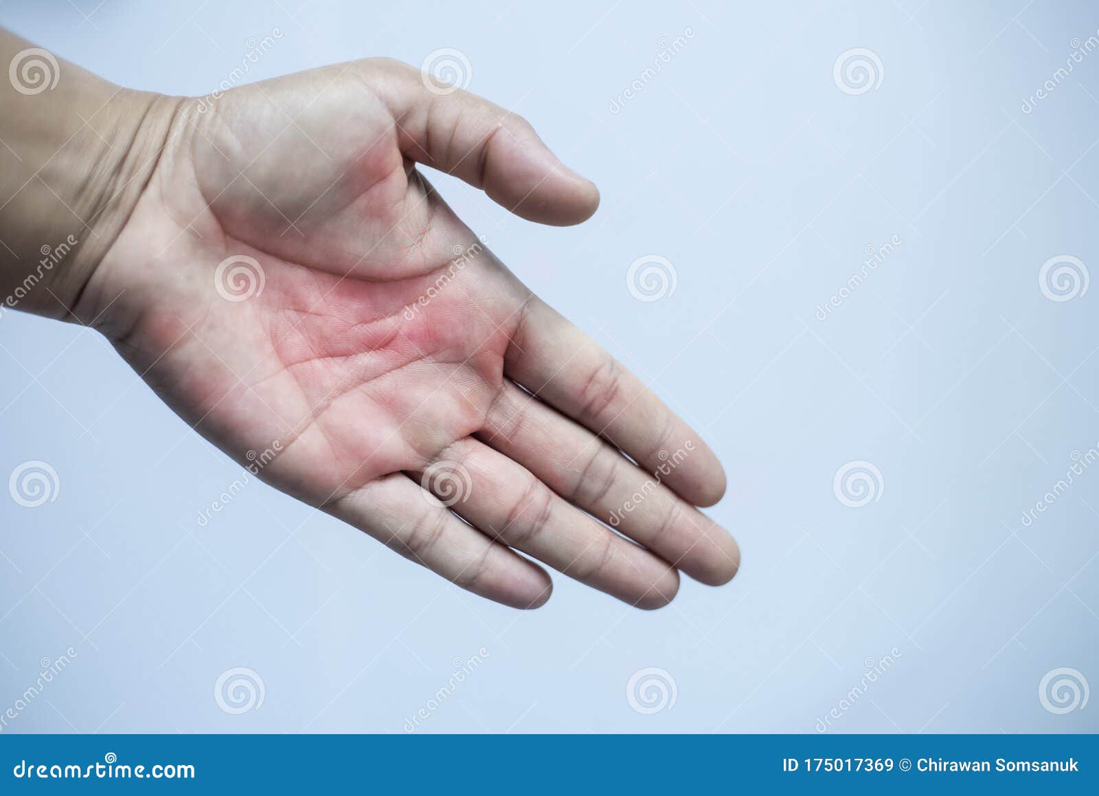 Bacteria or Virus Red Cell in Hand Stock Image - Image of medicine ...