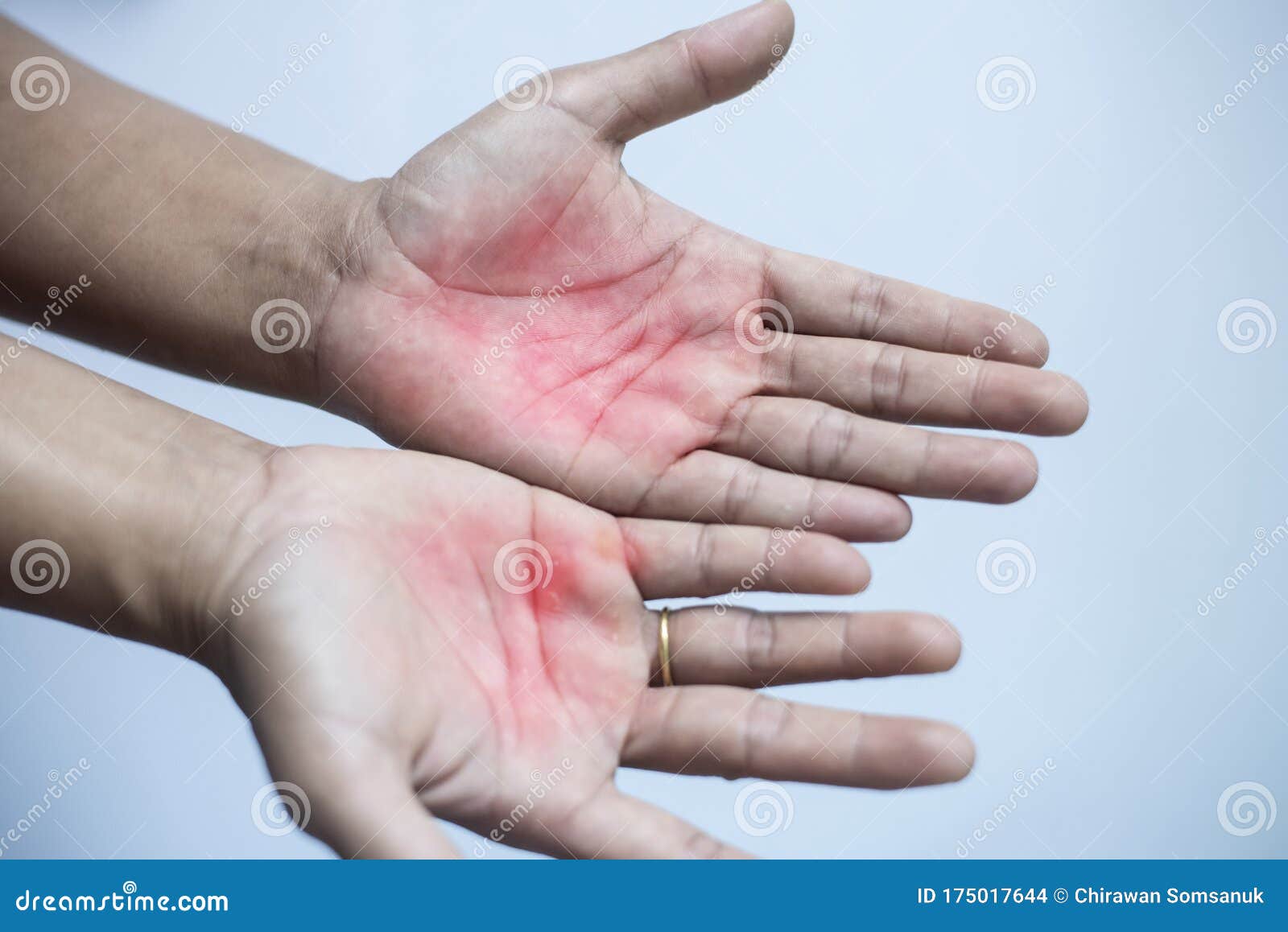 Bacteria or Virus Red Cell in Hand Stock Photo - Image of foam ...