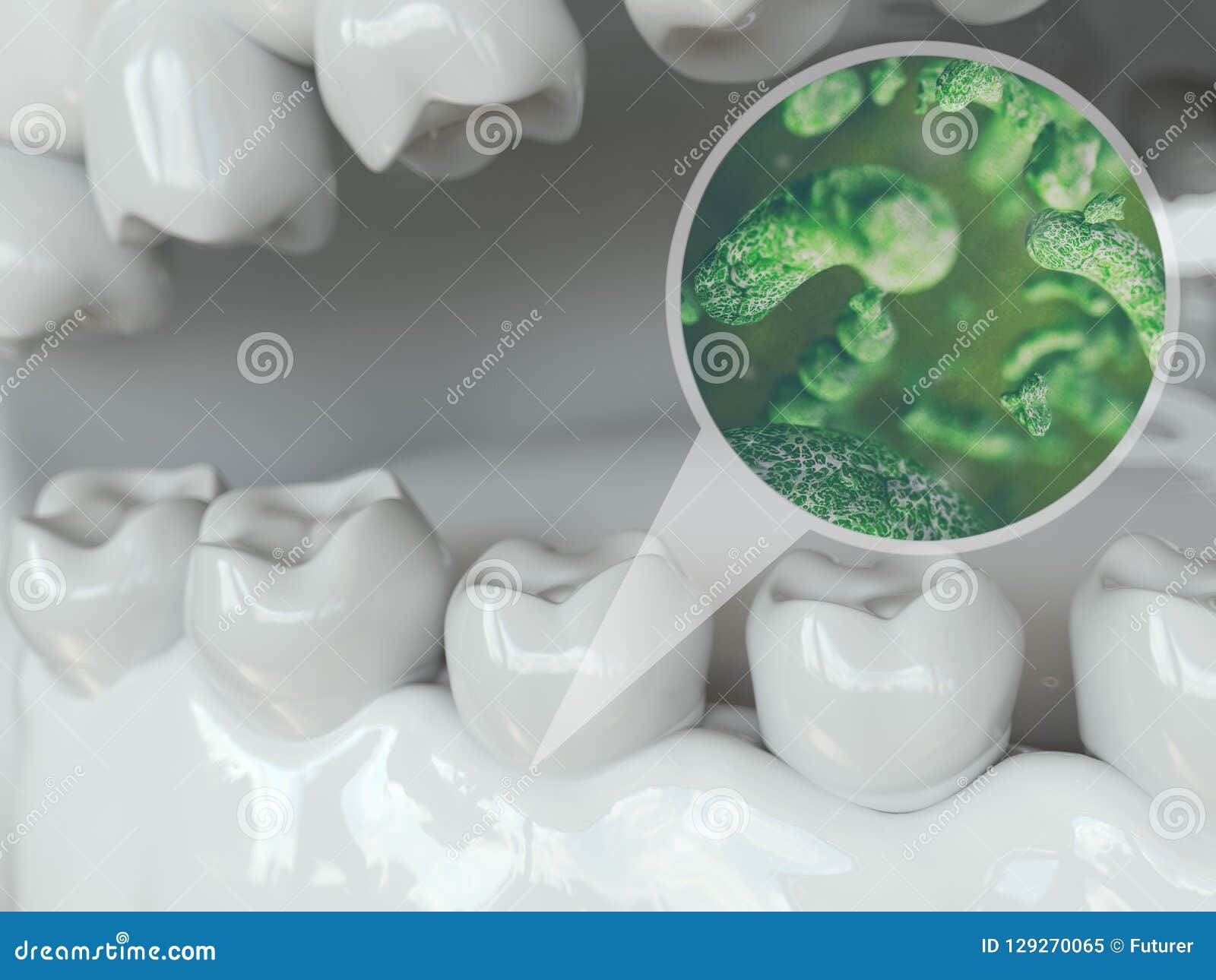 Bacteria and Viruses Around Tooth 2 of 2 - 3D Rendering Stock ...
