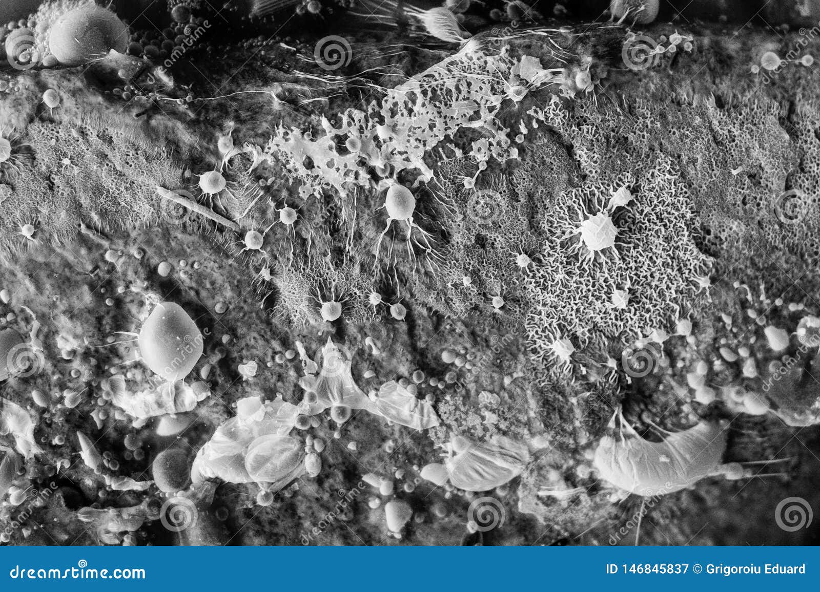 Closeup of a Bacterial Cololny with Mold Cells on Stock Image - Image ...
