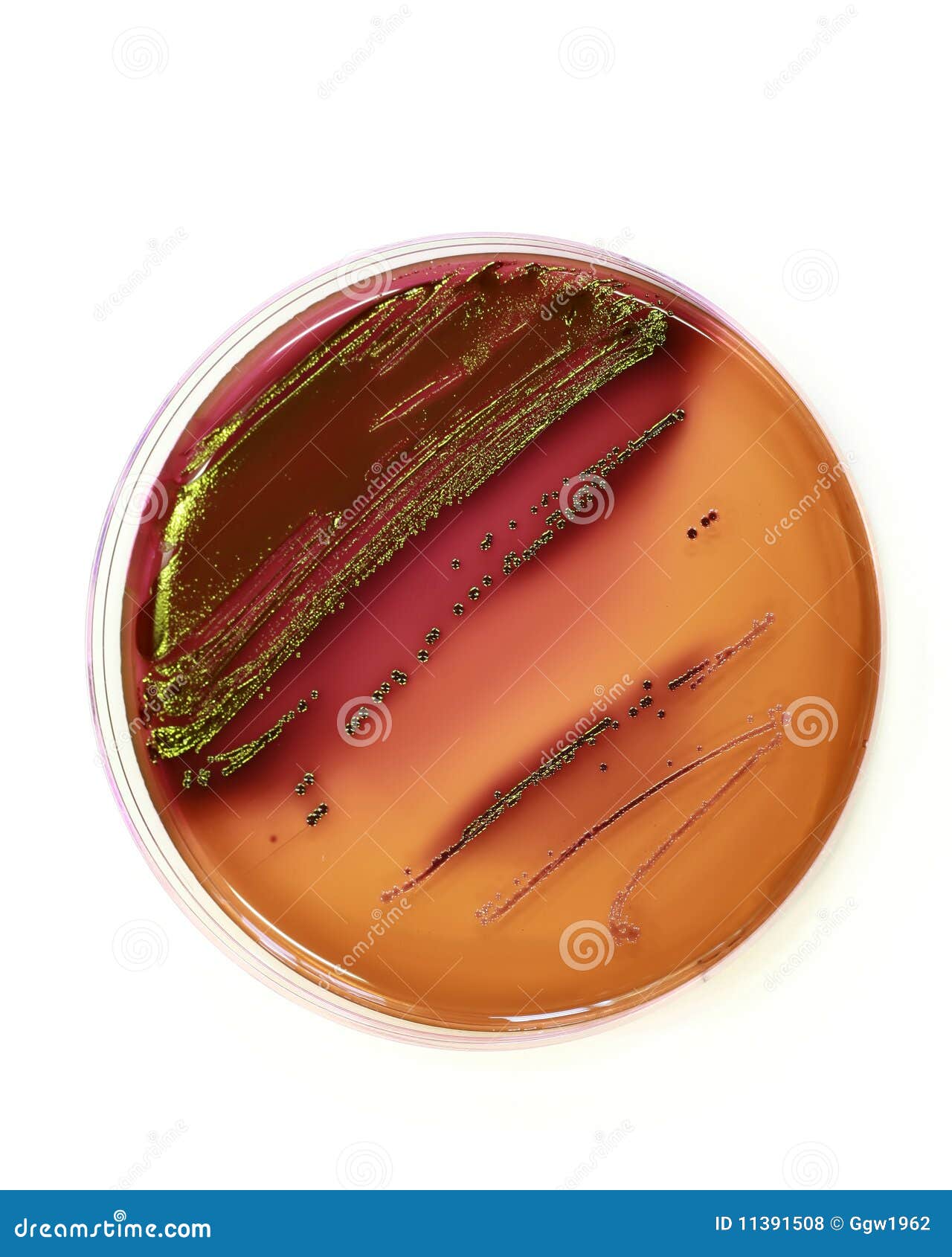 Bacterial Colonies Royalty-Free Stock Image | CartoonDealer.com #11391508