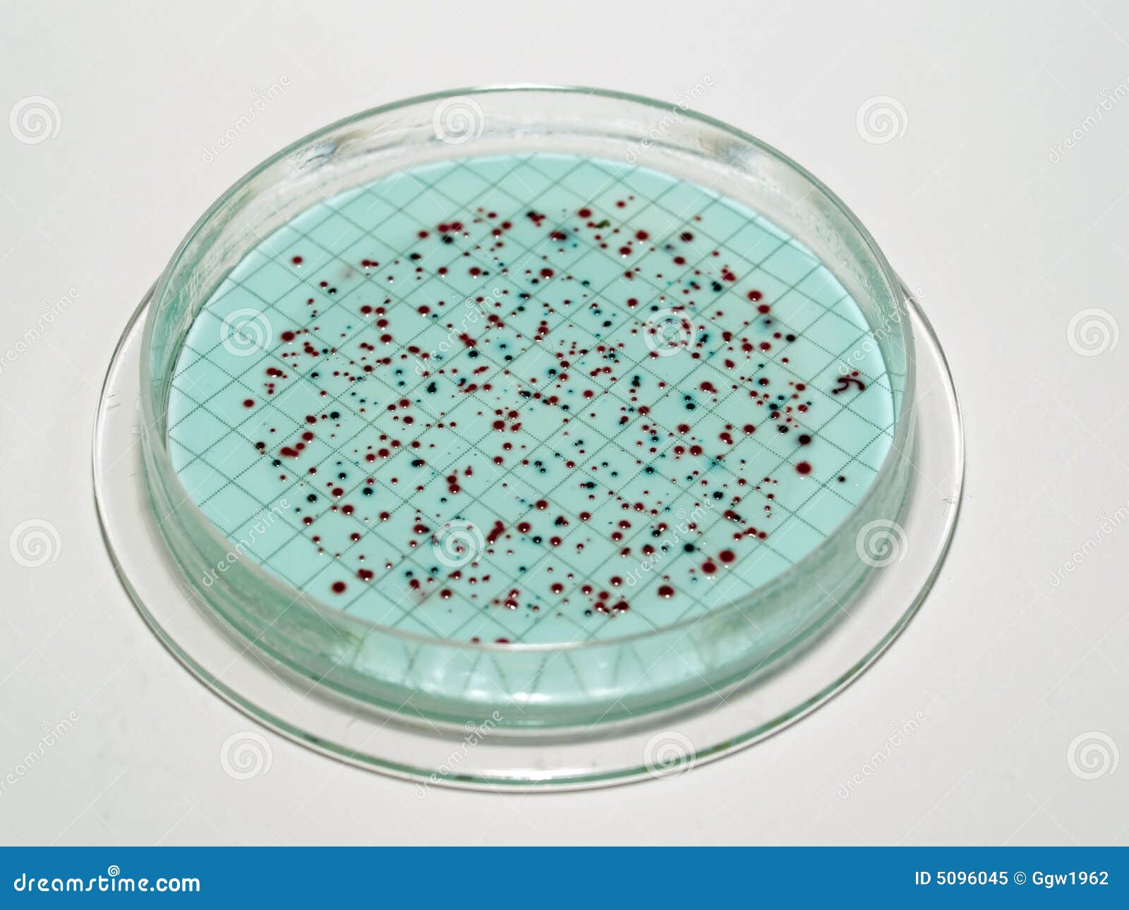 Bacterial colonies stock image. Image of coliform, disease - 5096045