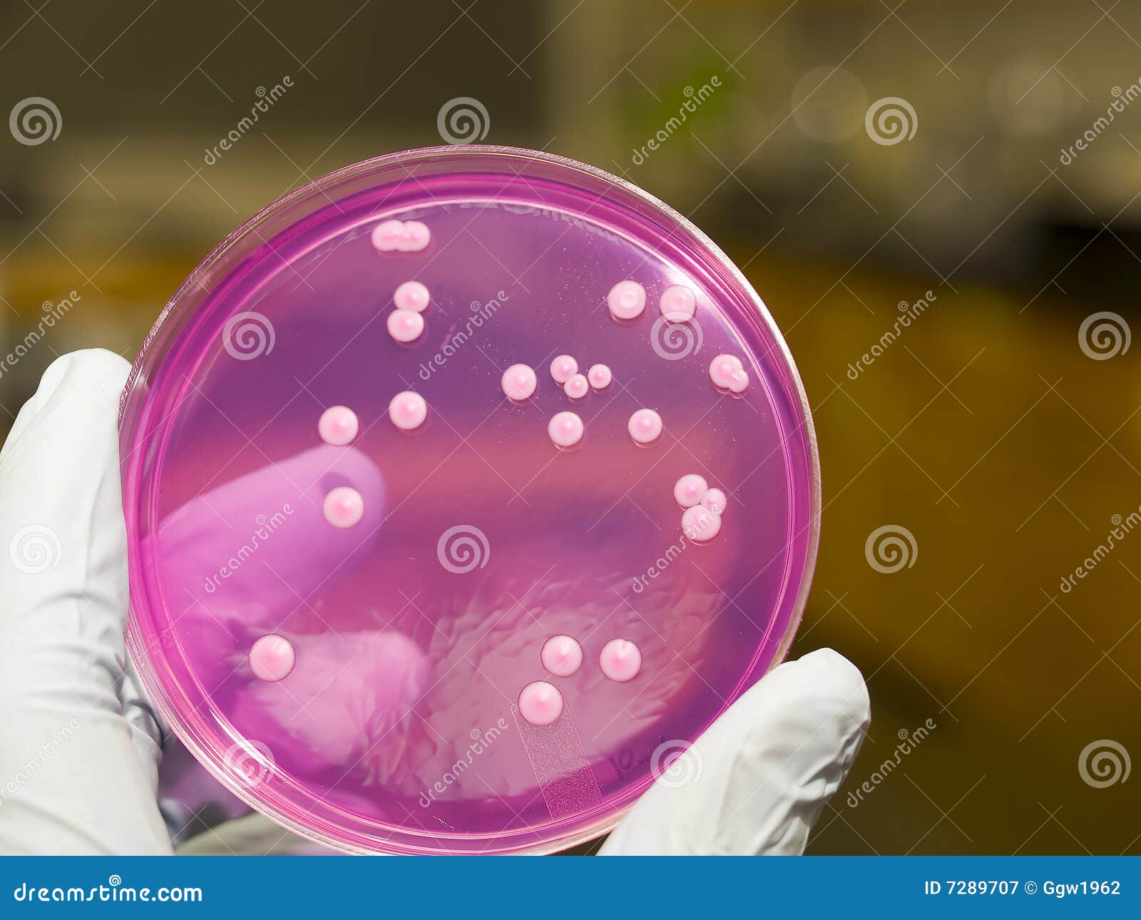 Bacterial colonies stock image. Image of disease, medical - 7289707